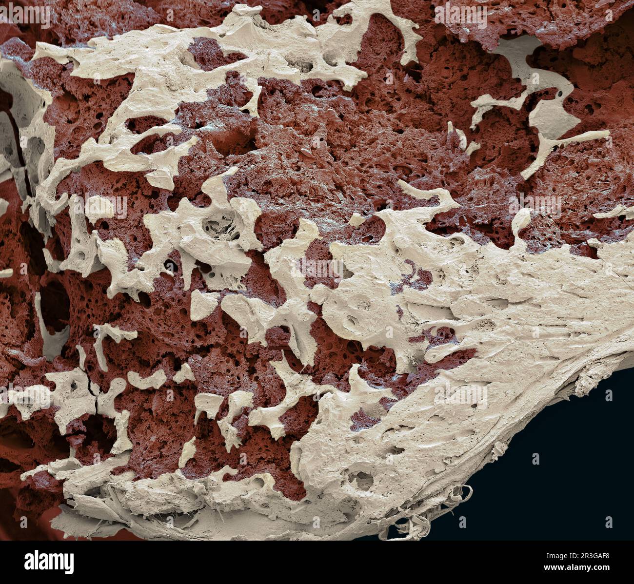 Bone marrow, SEM Stock Photo - Alamy
