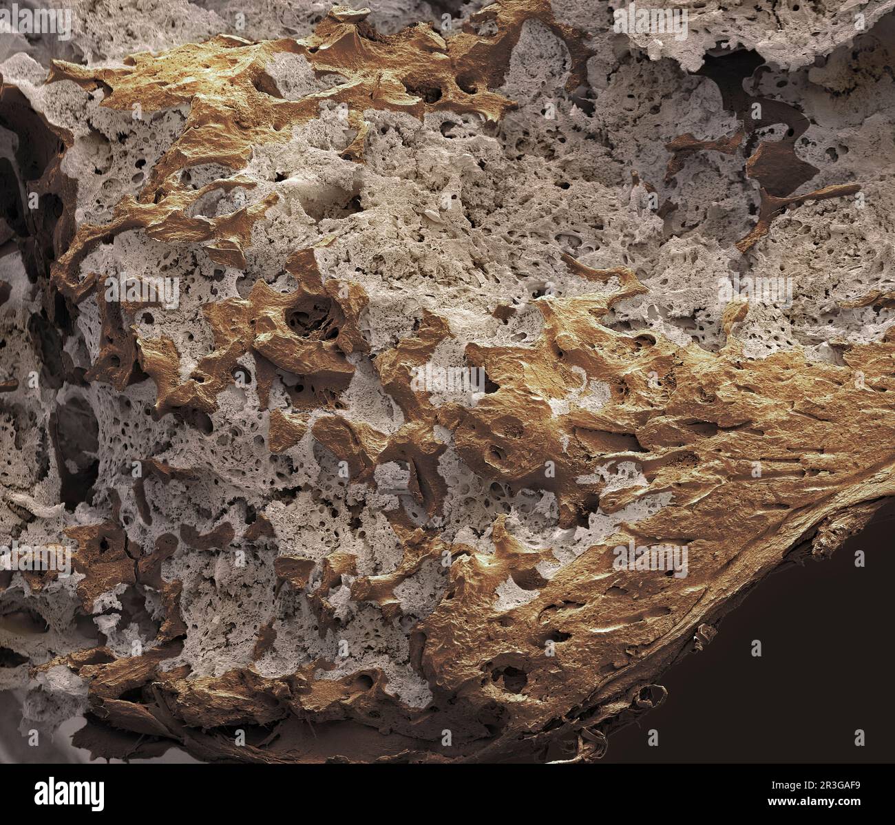 Bone marrow, SEM Stock Photo - Alamy