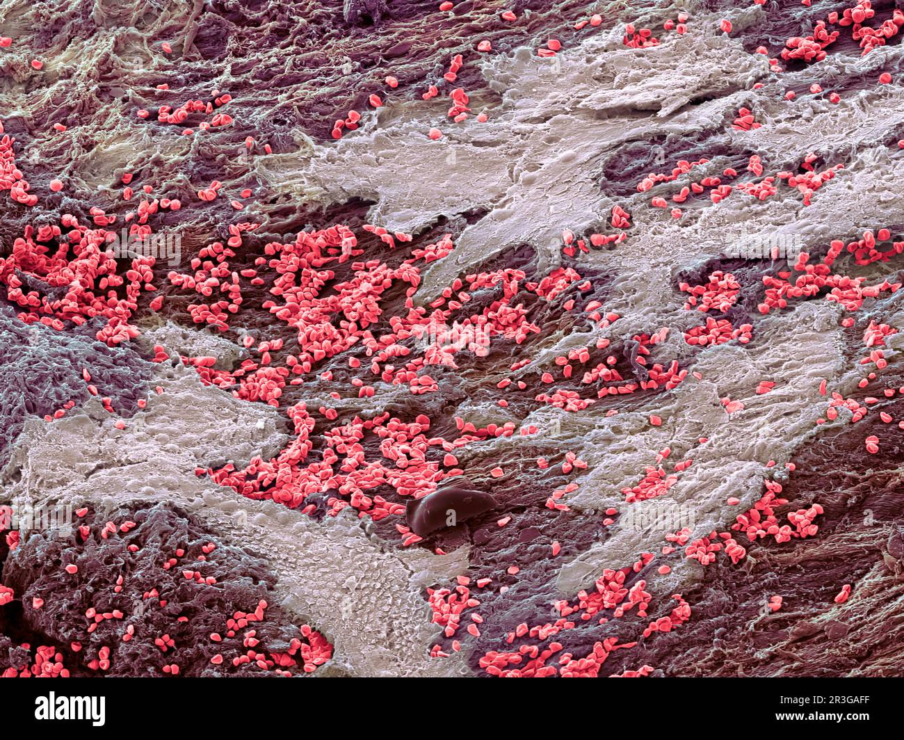 Uterus during menstruation, SEM Stock Photo - Alamy