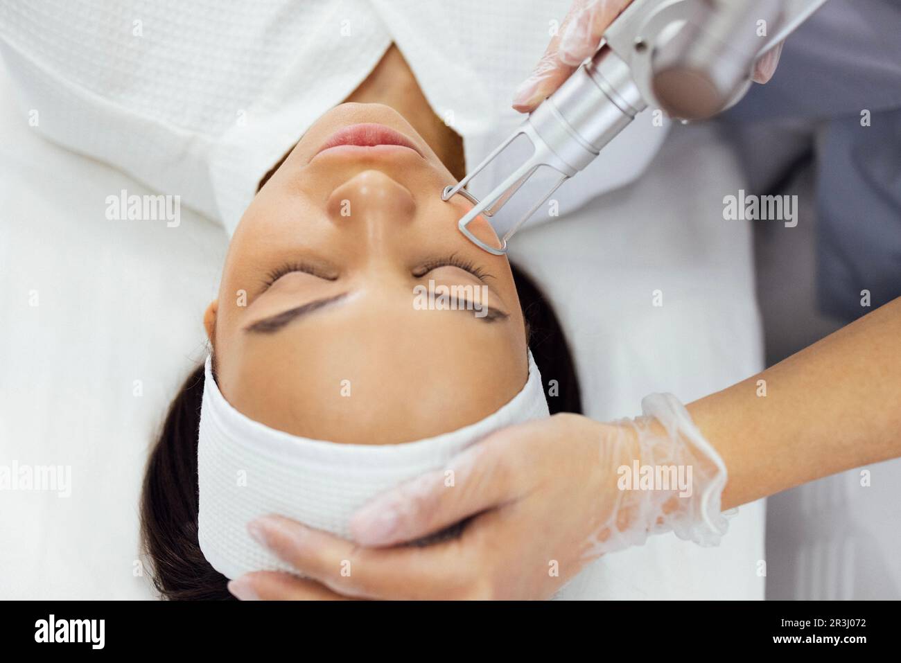 Closeup of the face of young woman undergoing laser resurfacing and ...