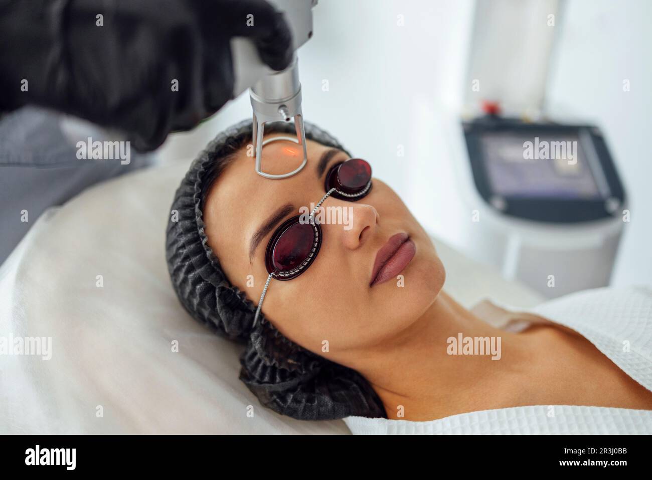 Closeup of the face of young woman undergoing laser resurfacing and ...