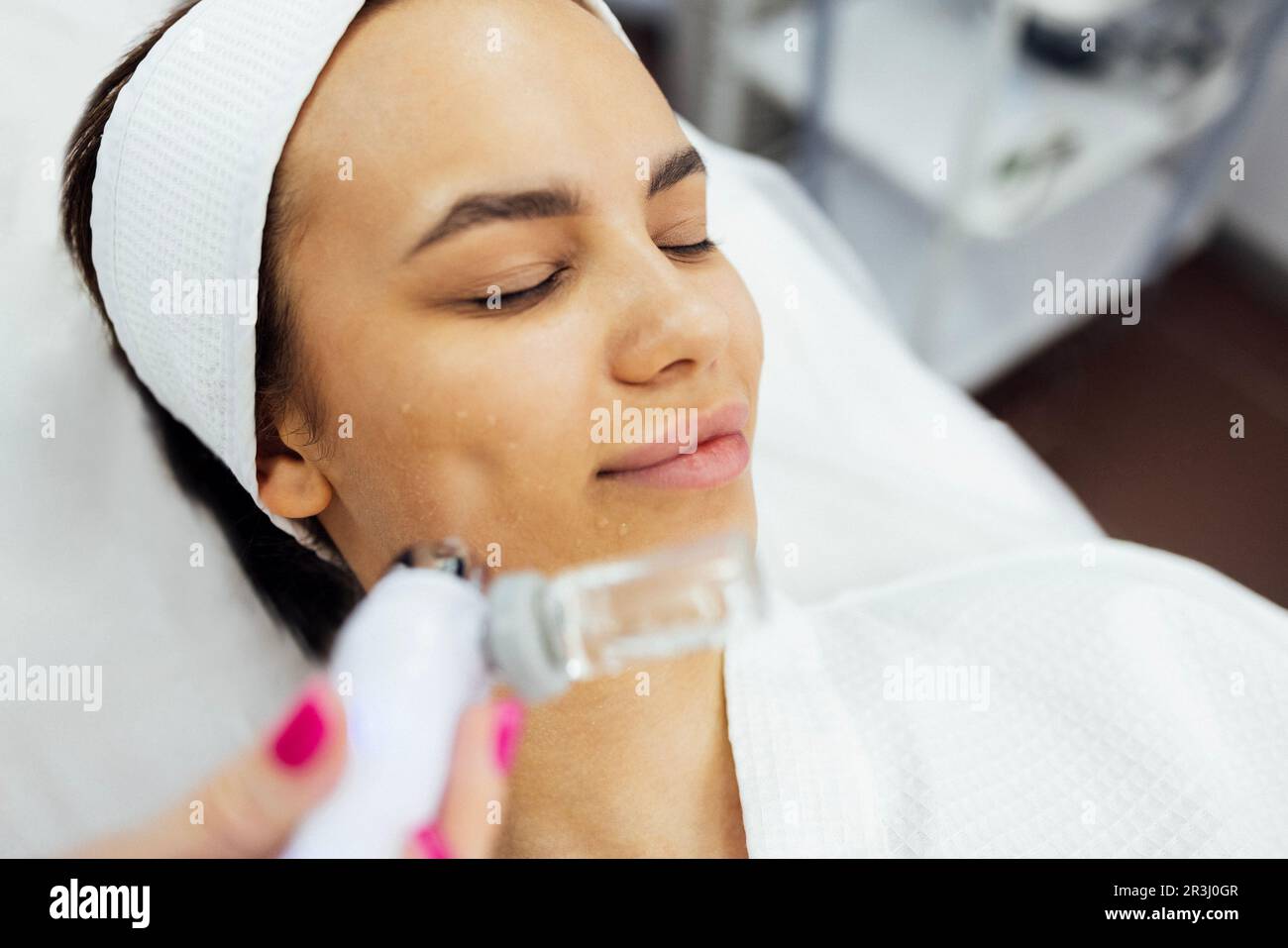 Caucasian woman getting face peeling procedure in a beauty clinic ...