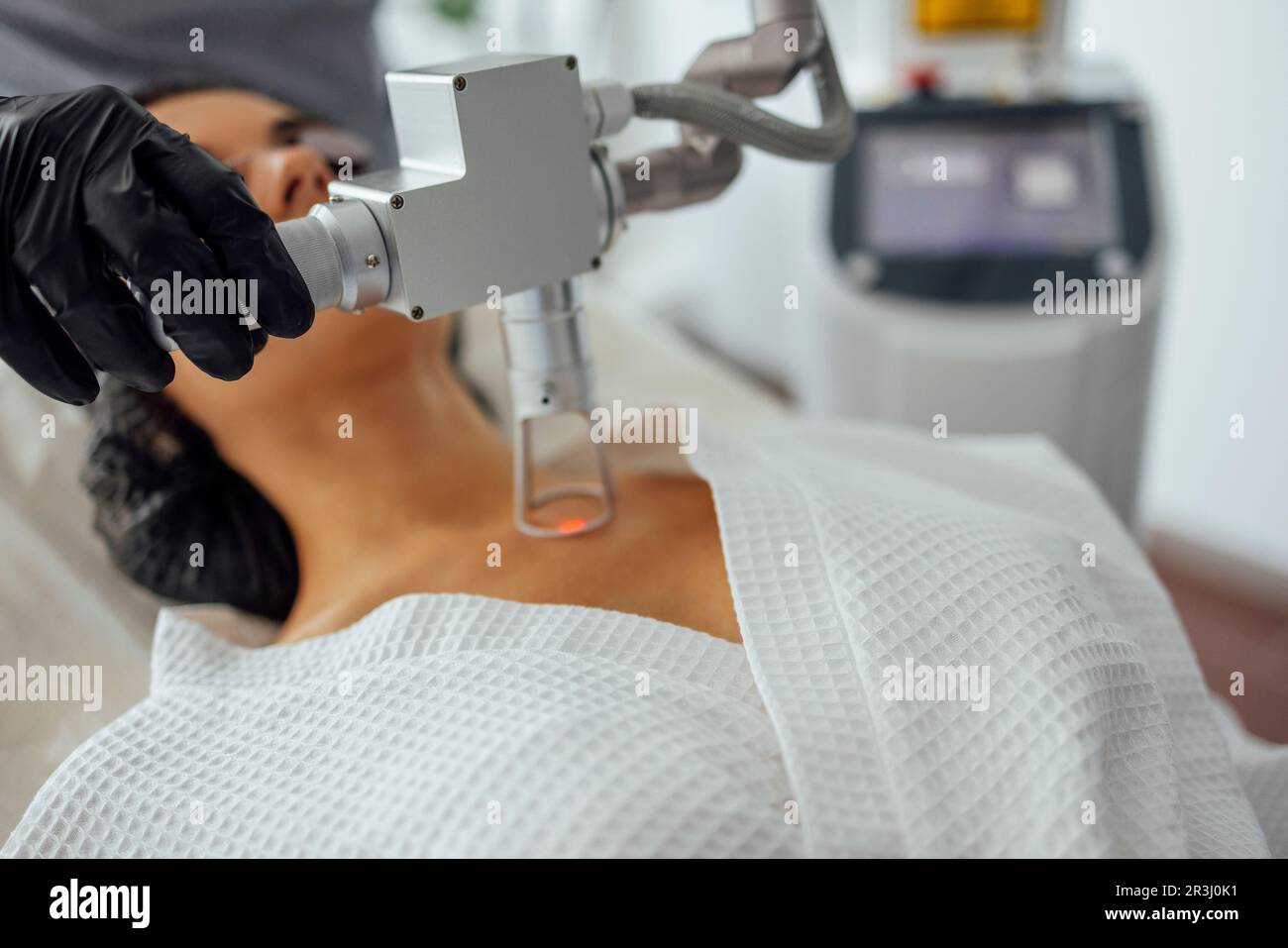 Closeup of the face of young woman undergoing laser resurfacing and ...
