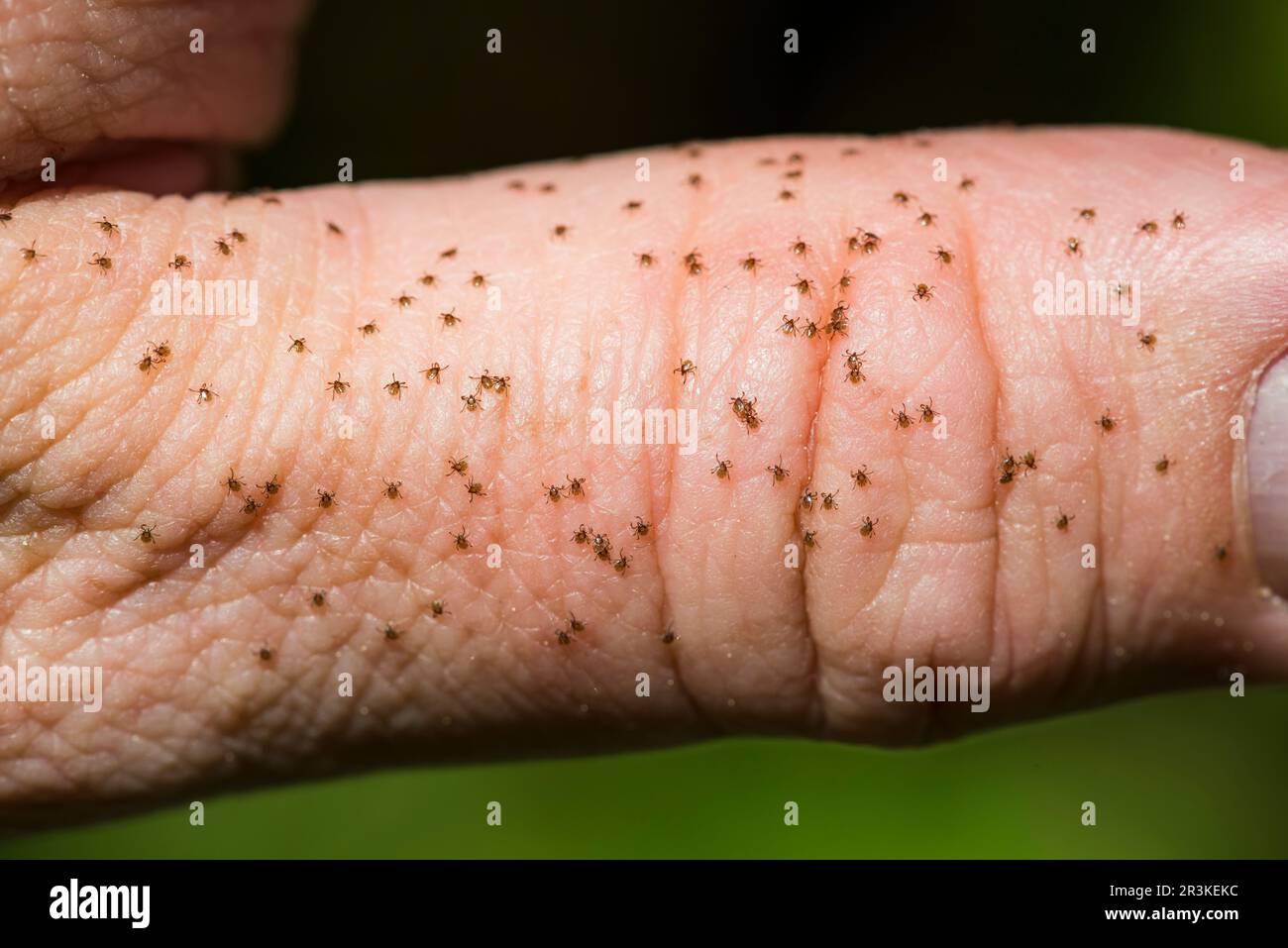 Large number of Sheep tick (Ixodes ricinus) larvae on a thumb, near the ...