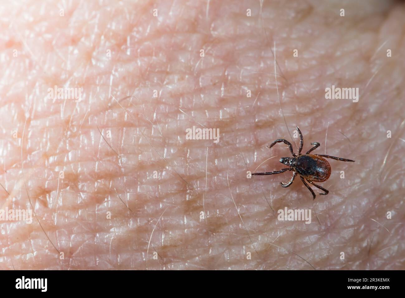 Sheep tick (Ixodes ricinus Stock Photo - Alamy