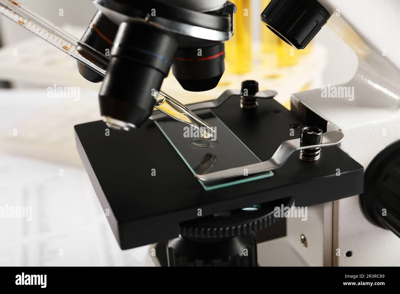 Microscope with drop of urine on glass slide in laboratory, closeup ...