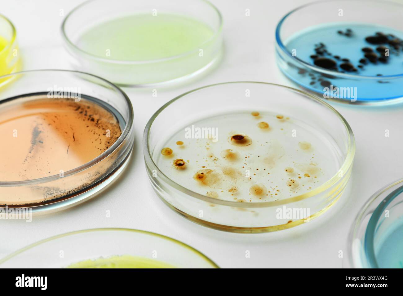Petri dishes with different bacteria colonies on white background ...