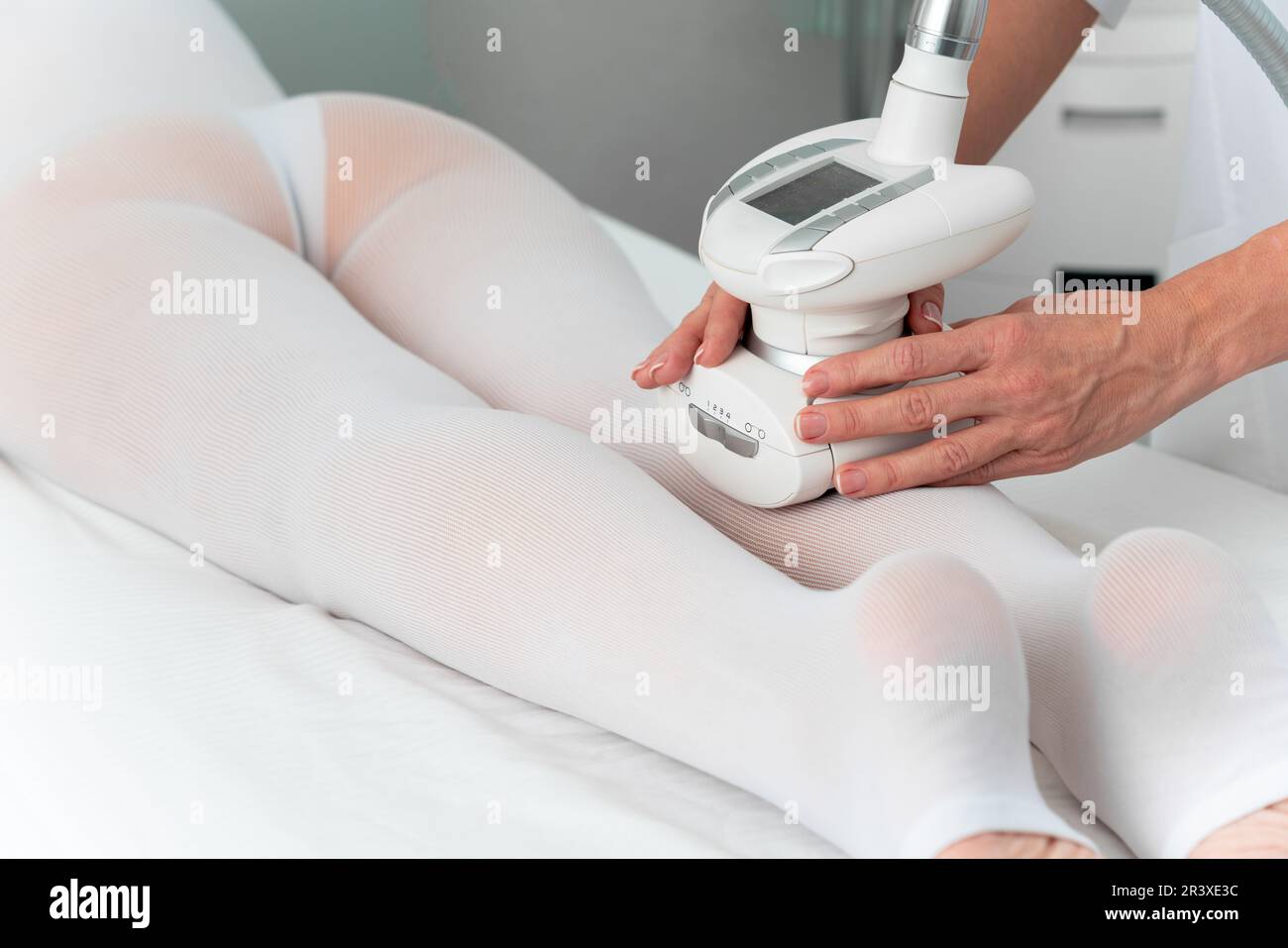 Woman in special white suit getting anti cellulite massage for legs in a spa salon. LPG, and ...