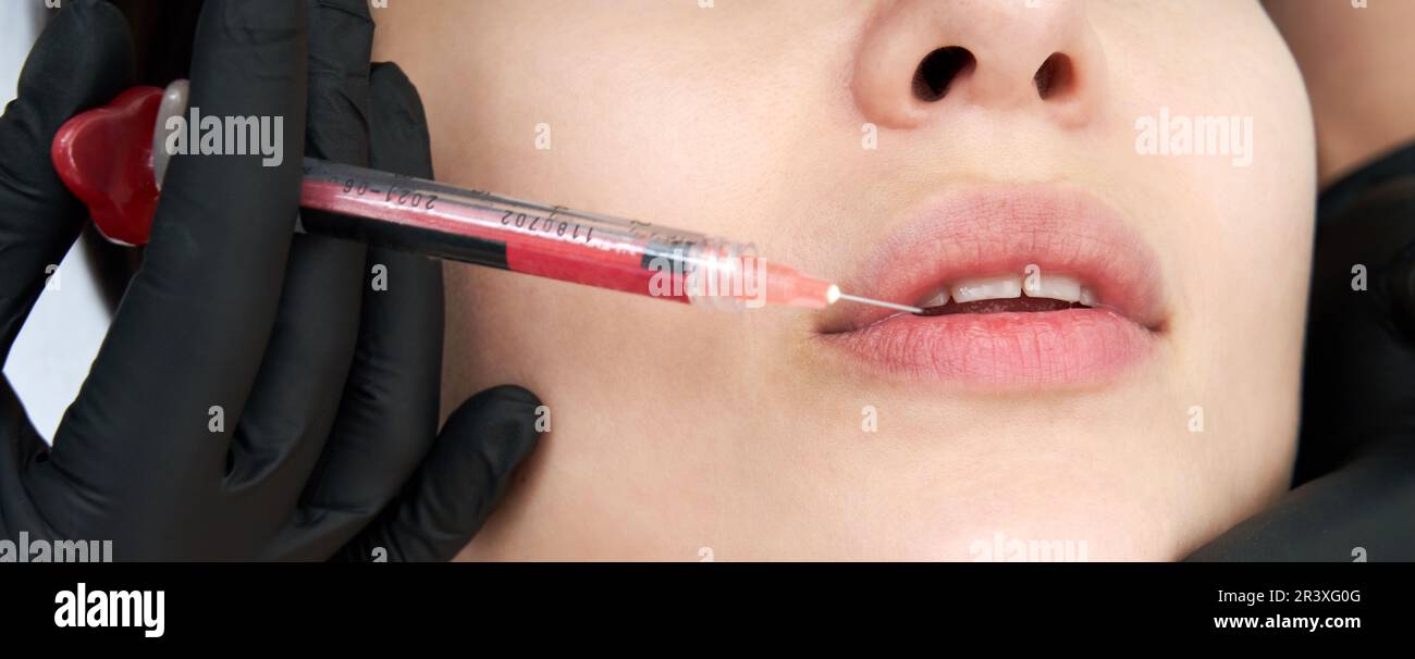 Beautiful woman gets an injection in her lips Stock Photo - Alamy