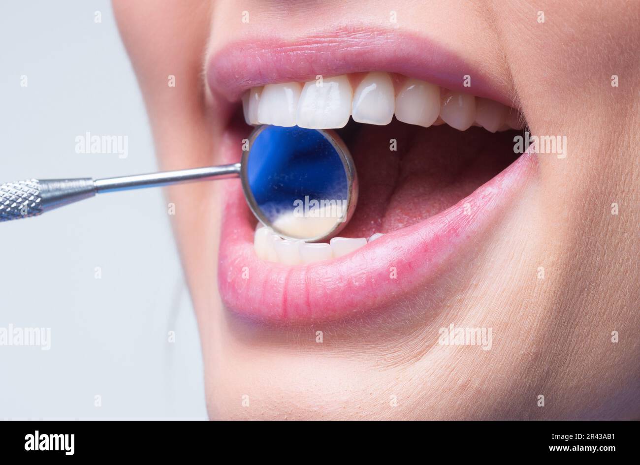 Teeth mirror close-up. Examination of teeth with dental mirror. Tooth ...