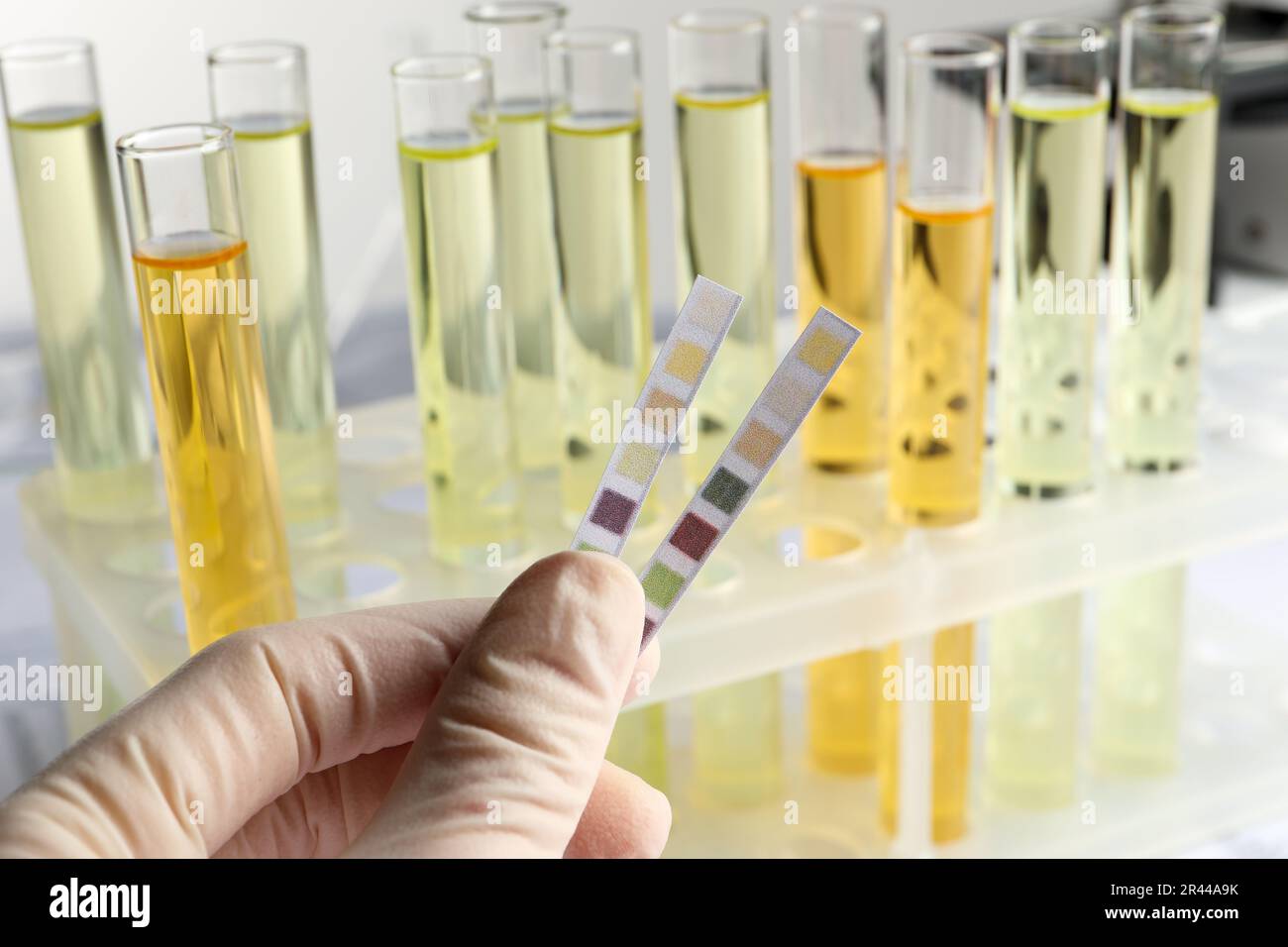 Nurse holding tube with urine sample for analysis on light grey ...