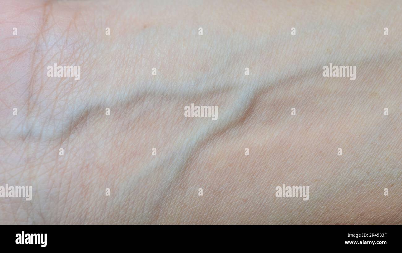 Veins arm woman hi-res stock photography and images - Alamy