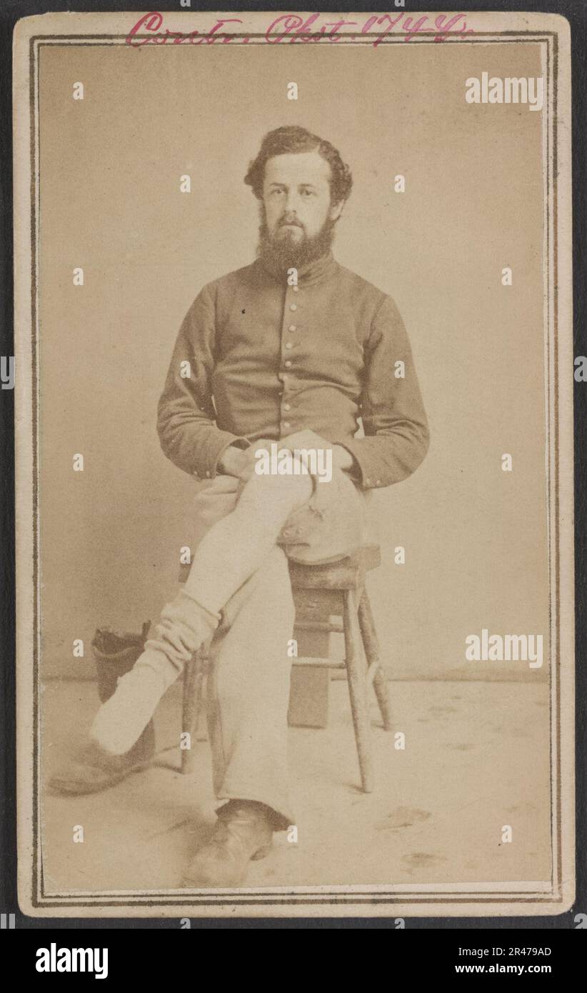 Unidentified soldier in Union private's uniform displaying his leg ...