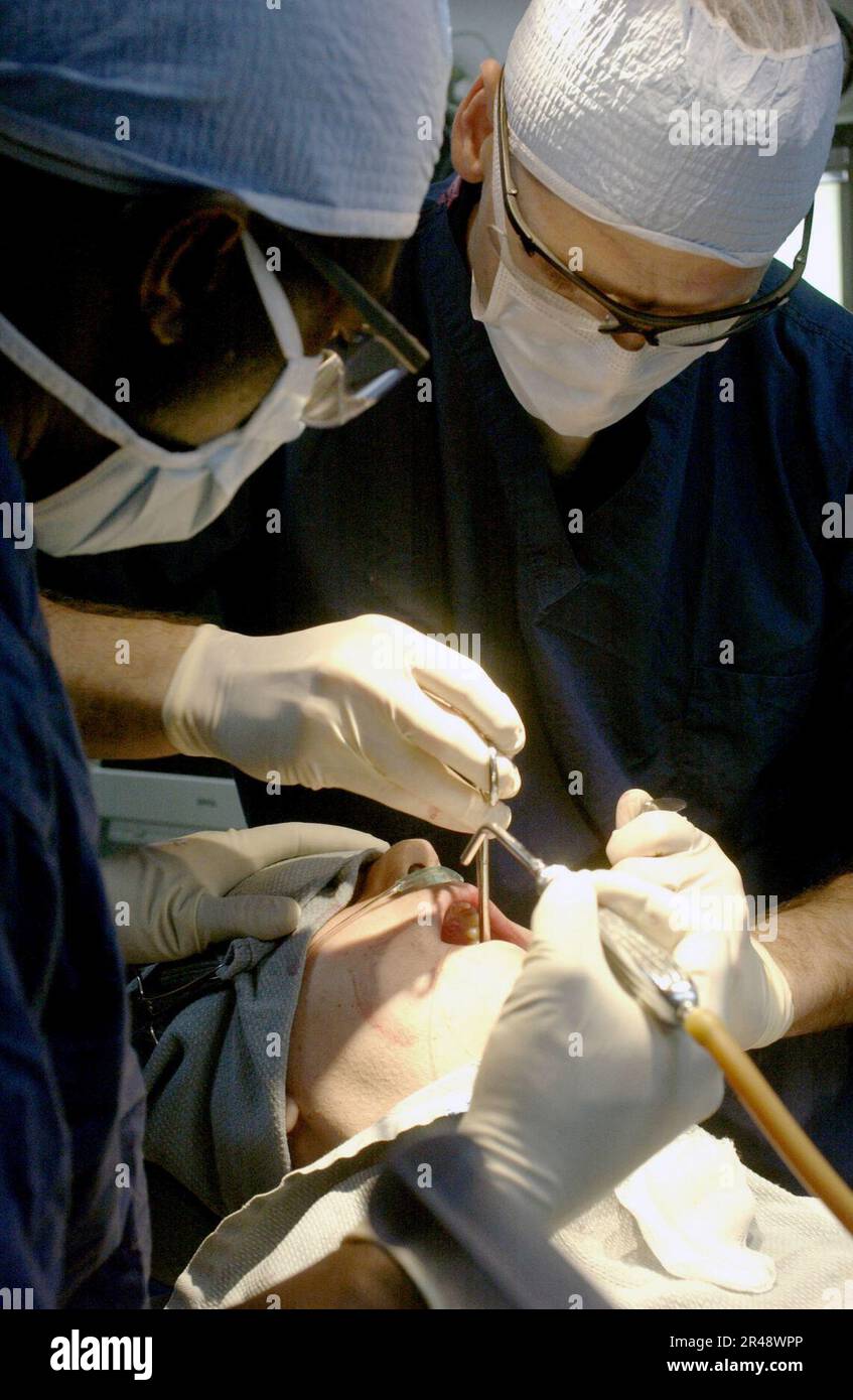 US Navy perform an extraction of all four wisdom teeth Stock Photo - Alamy