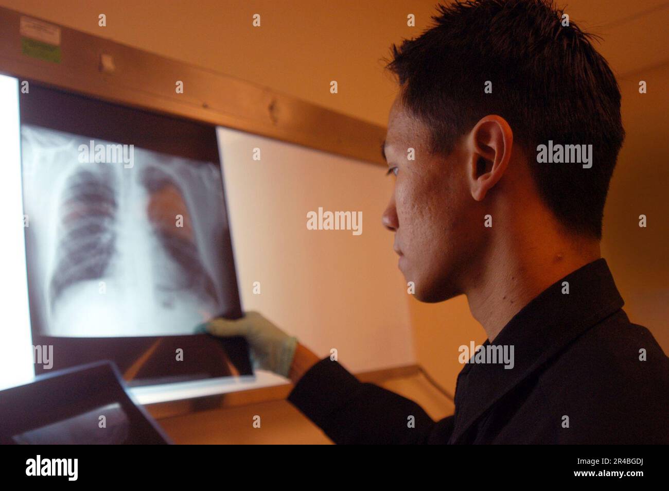 US Navy U.S. Navy Hospital Corpsman 2nd Class examines a chest X-Ray ...
