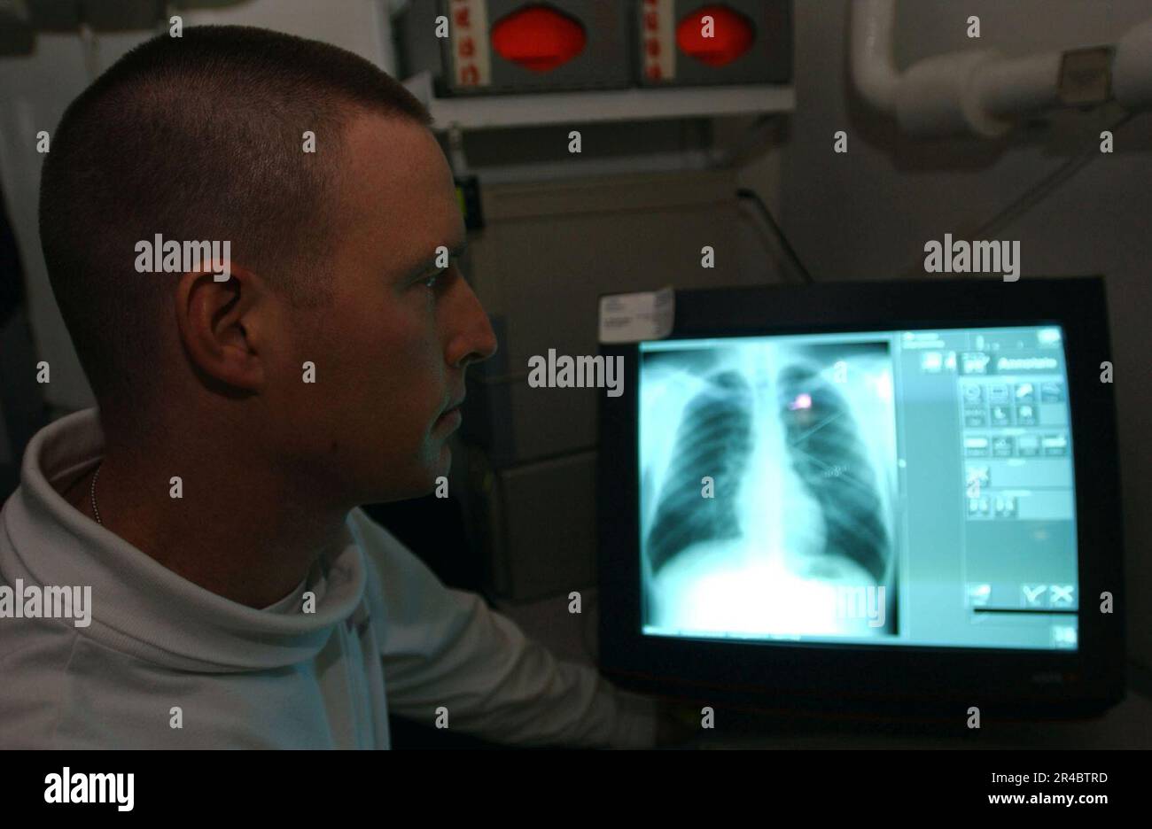 US Navy Hospital Corpsman 1st Class reviews a chest x-ray on the ...