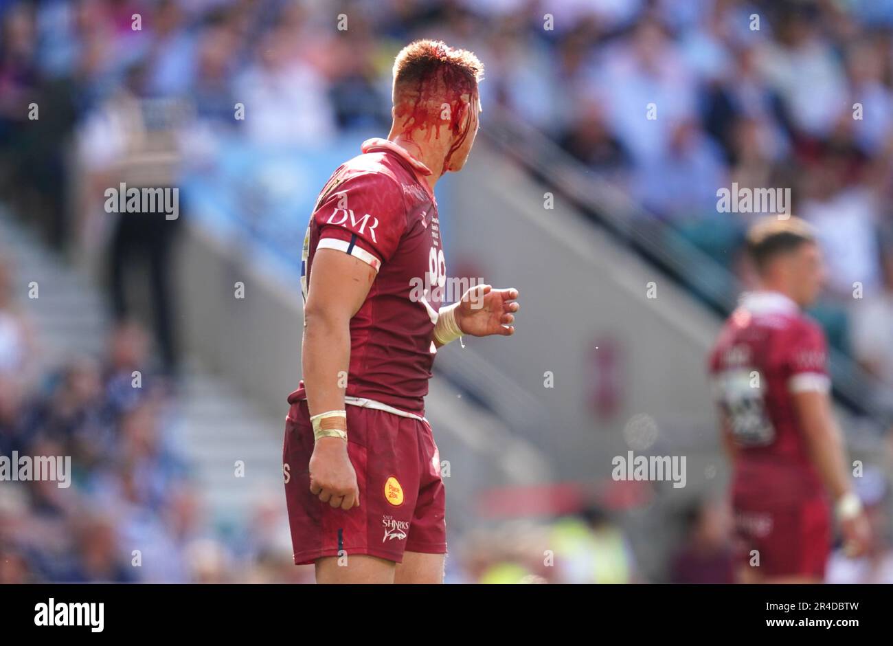 Sale Sharks' Joe Carpenter with a head injury during the Gallagher ...