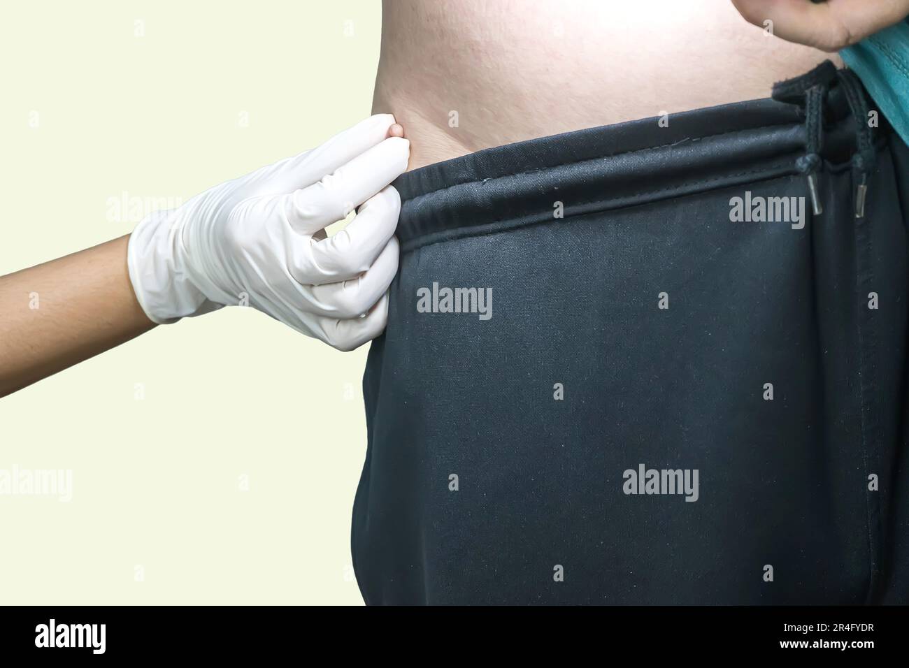 Skin tag or acrochondon or soft fibroma is a safe. It have not effect ...