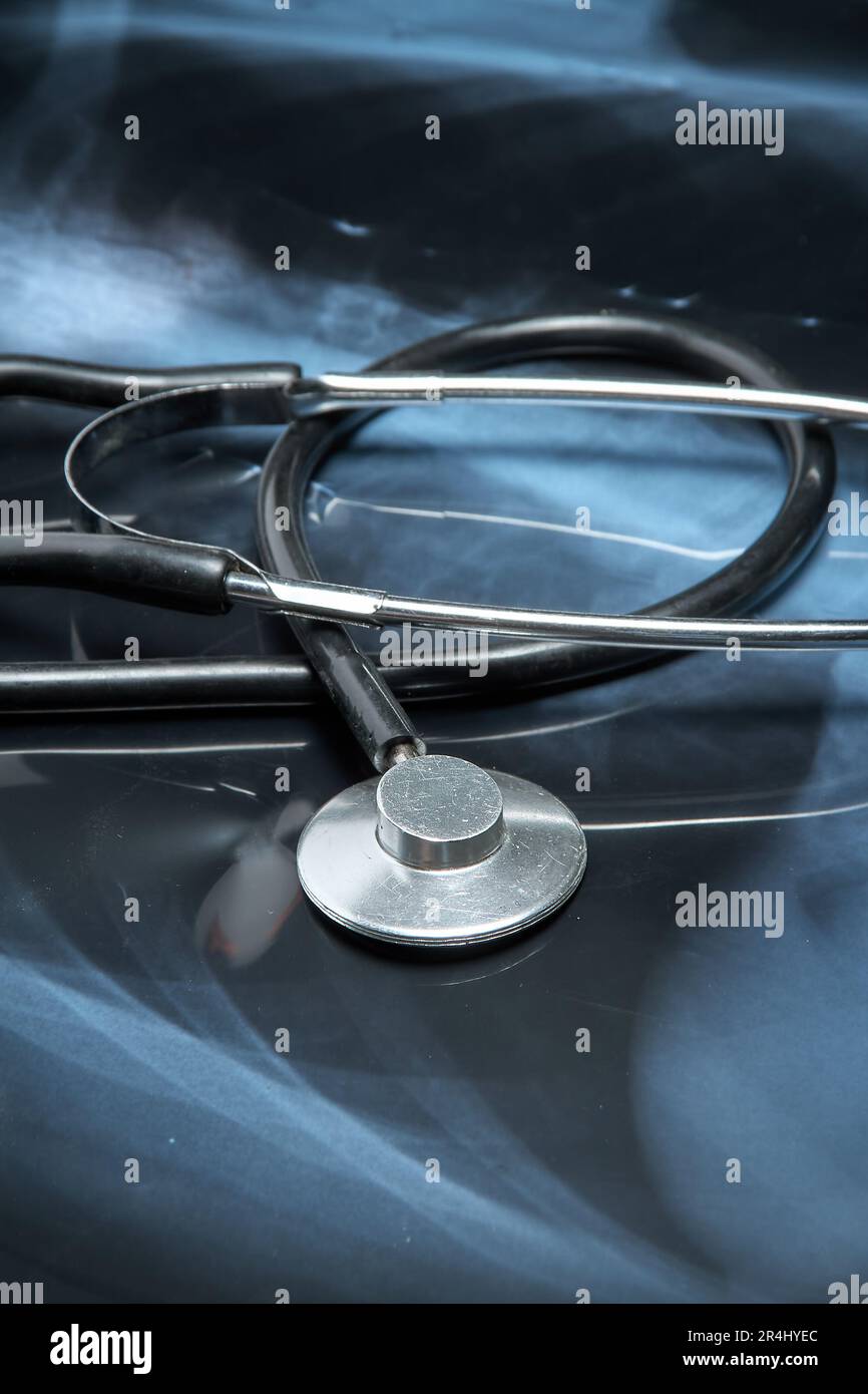 Medical stethoscope and X-ray of the patient's chest. Medical ...