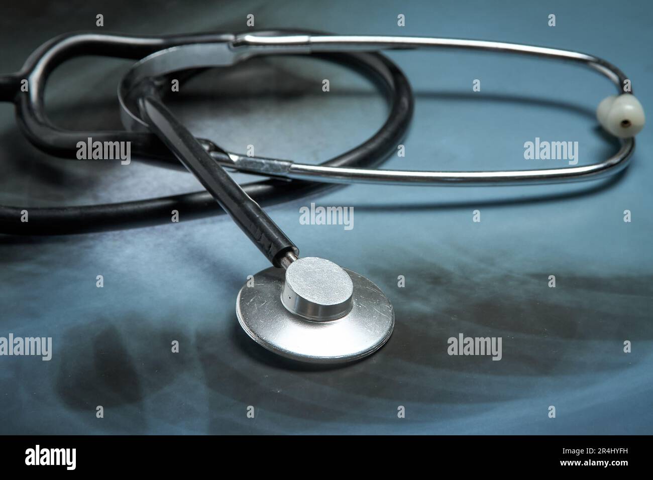 Medical stethoscope and chest X-ray. Medical examination Stock Photo ...