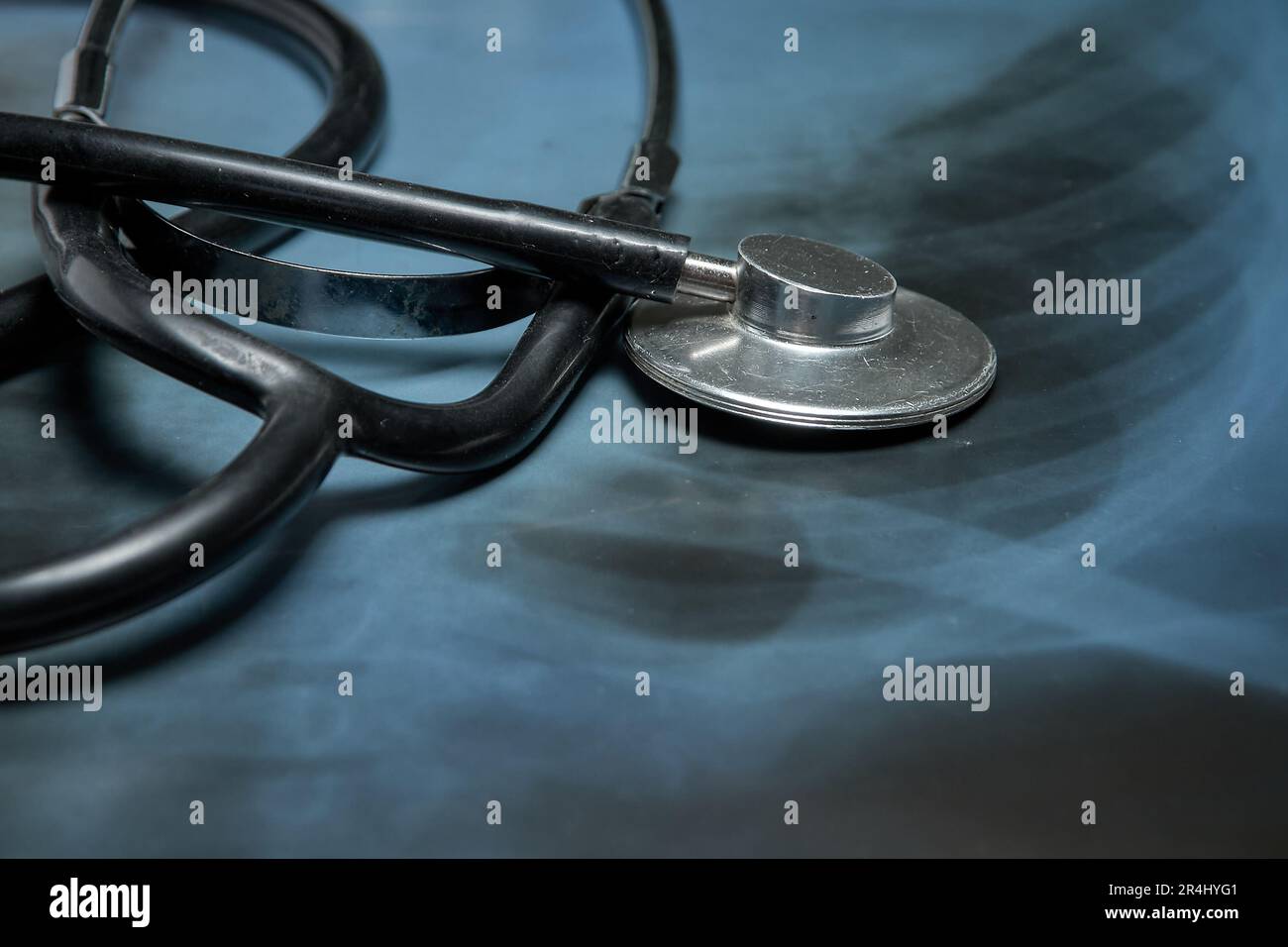 Medical stethoscope and chest X-ray. Medical examination Stock Photo ...