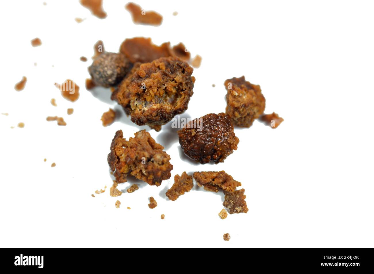 Nephrolithiasis, irregular brown kidney stones (renal calculus or ...