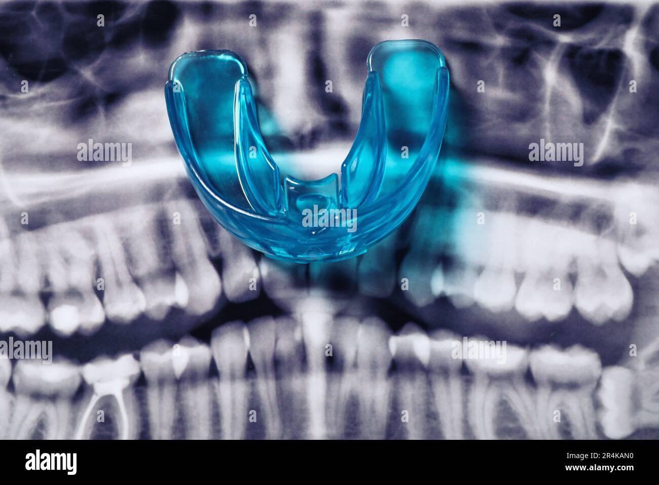 Mouth guard on dental scan, top view. Bite correction Stock Photo - Alamy