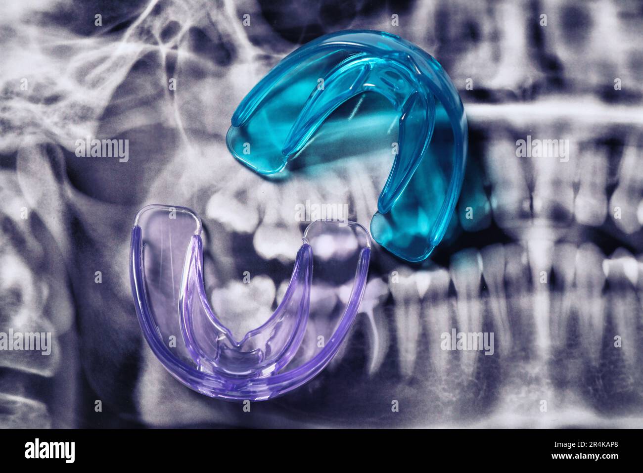 Mouth guards on dental scan, flat lay. Bite correction Stock Photo - Alamy
