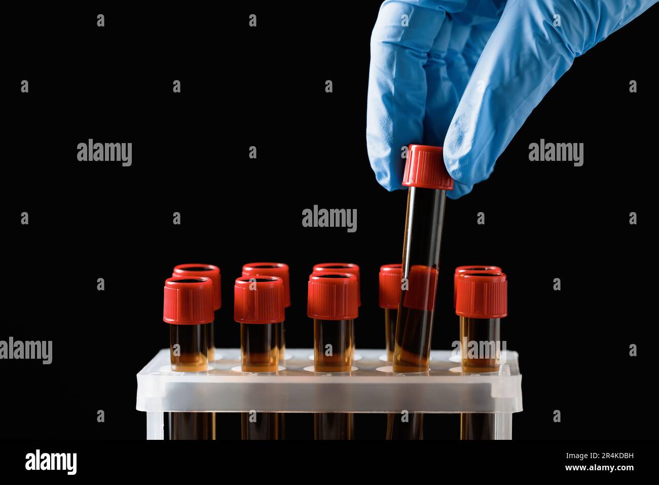 Scientist putting test tube with brown liquid into stand against black ...
