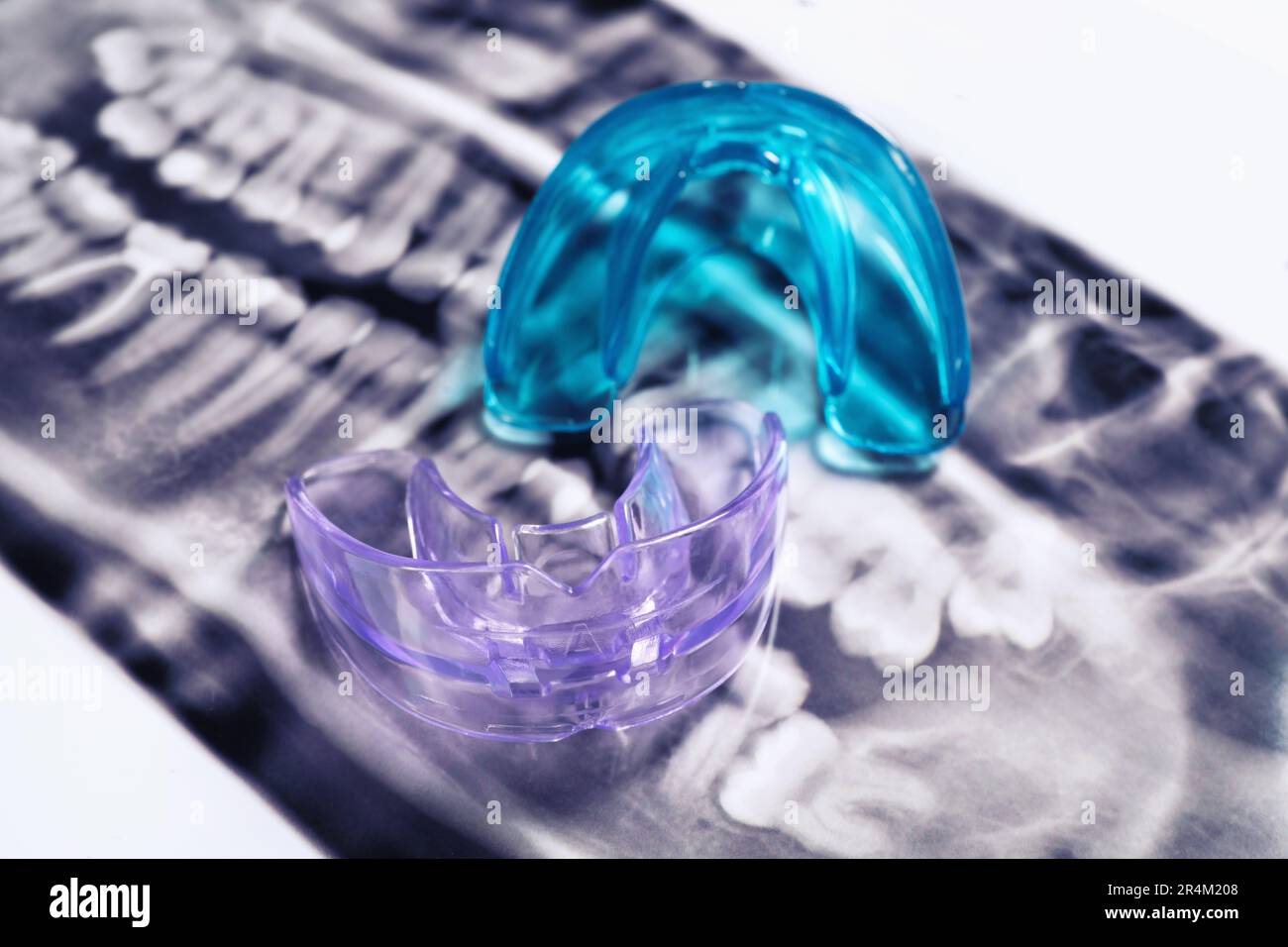 Mouth guards on dental scan, closeup. Bite correction Stock Photo - Alamy
