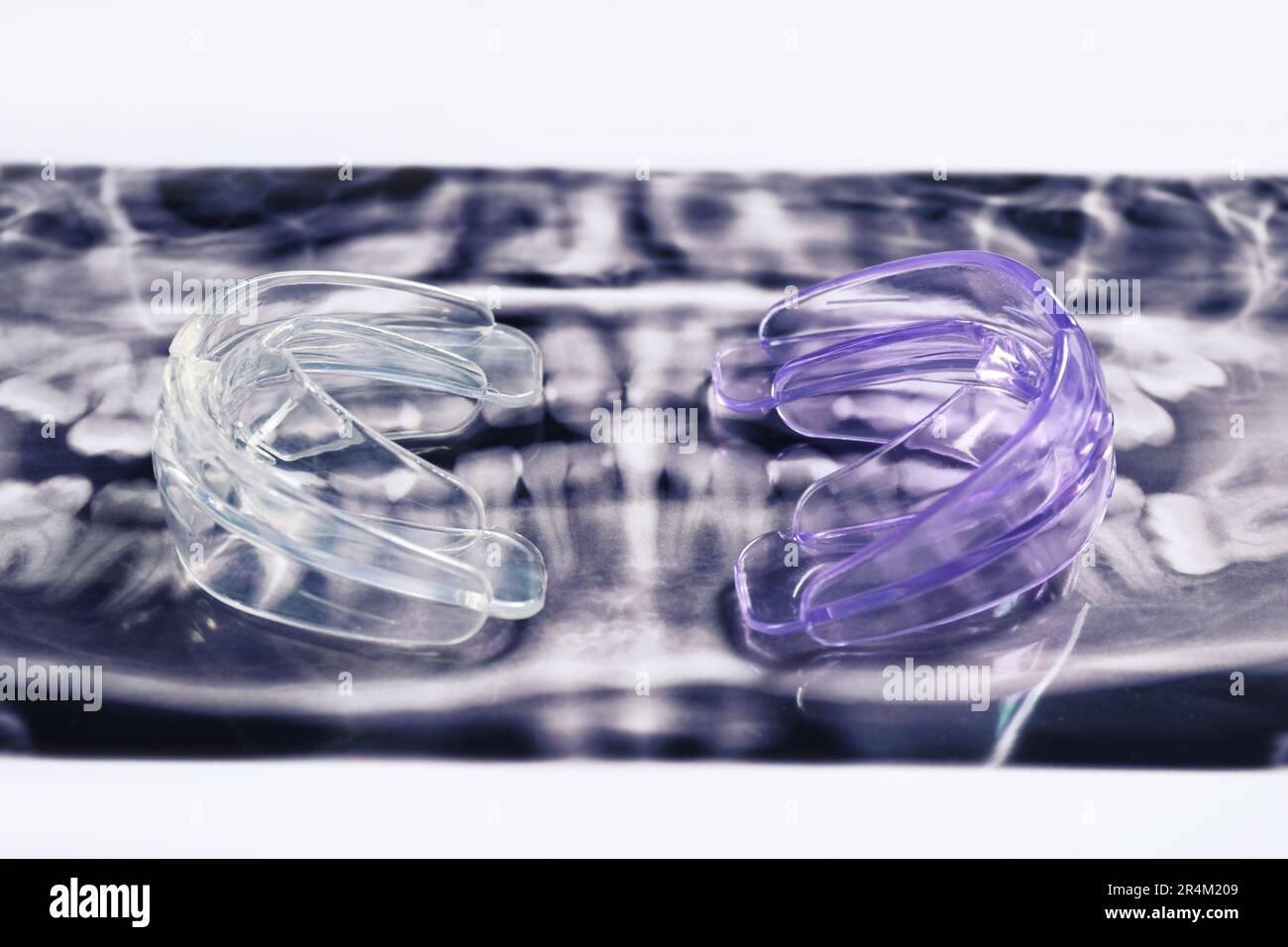 Mouth guards on dental scan, closeup. Bite correction Stock Photo - Alamy