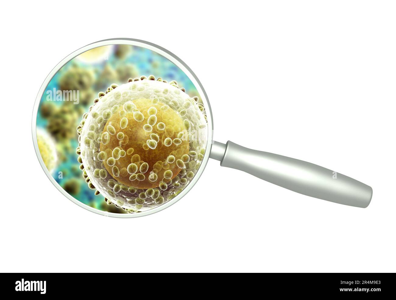 Magnifying glass and pathogenic bacterias and viruses. Fast ...