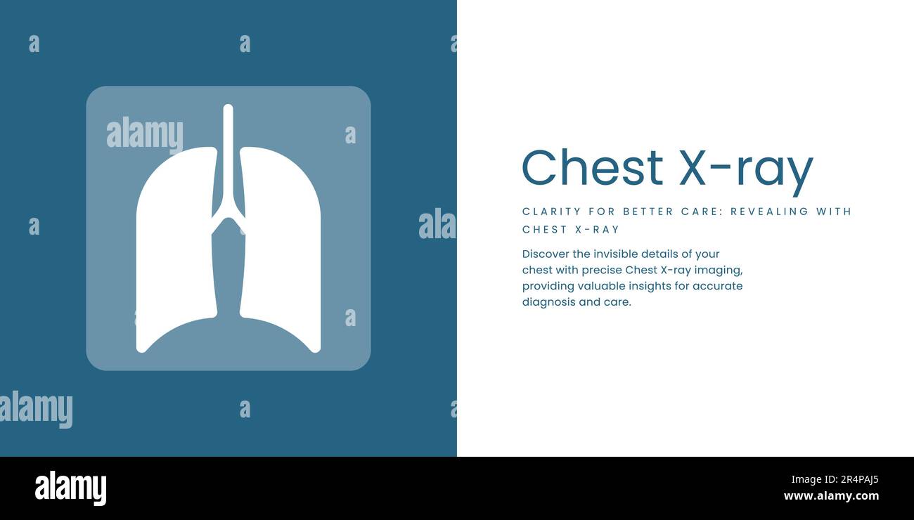 Chest X-ray Banner on Blue and White Background. Stylish Banner with ...