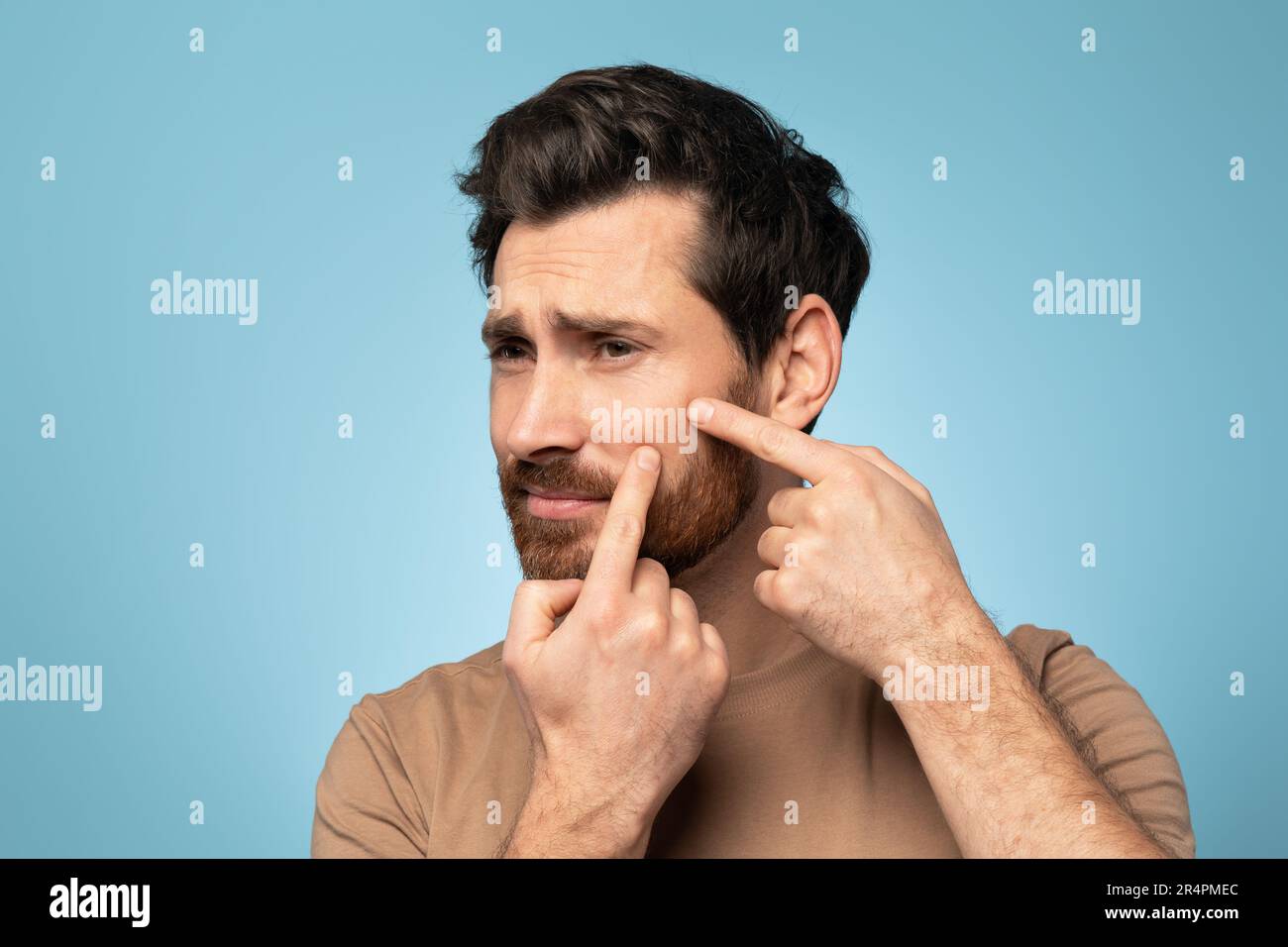 Bearded middle aged man touching his face, removing blackheads ...