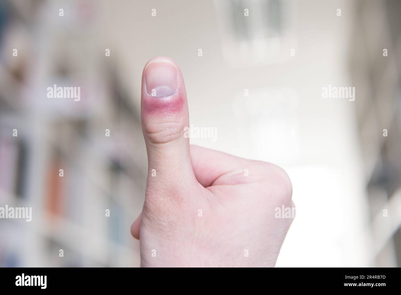 Man Suffering From Hand and Finger in Pain With Red Highlight Stock ...