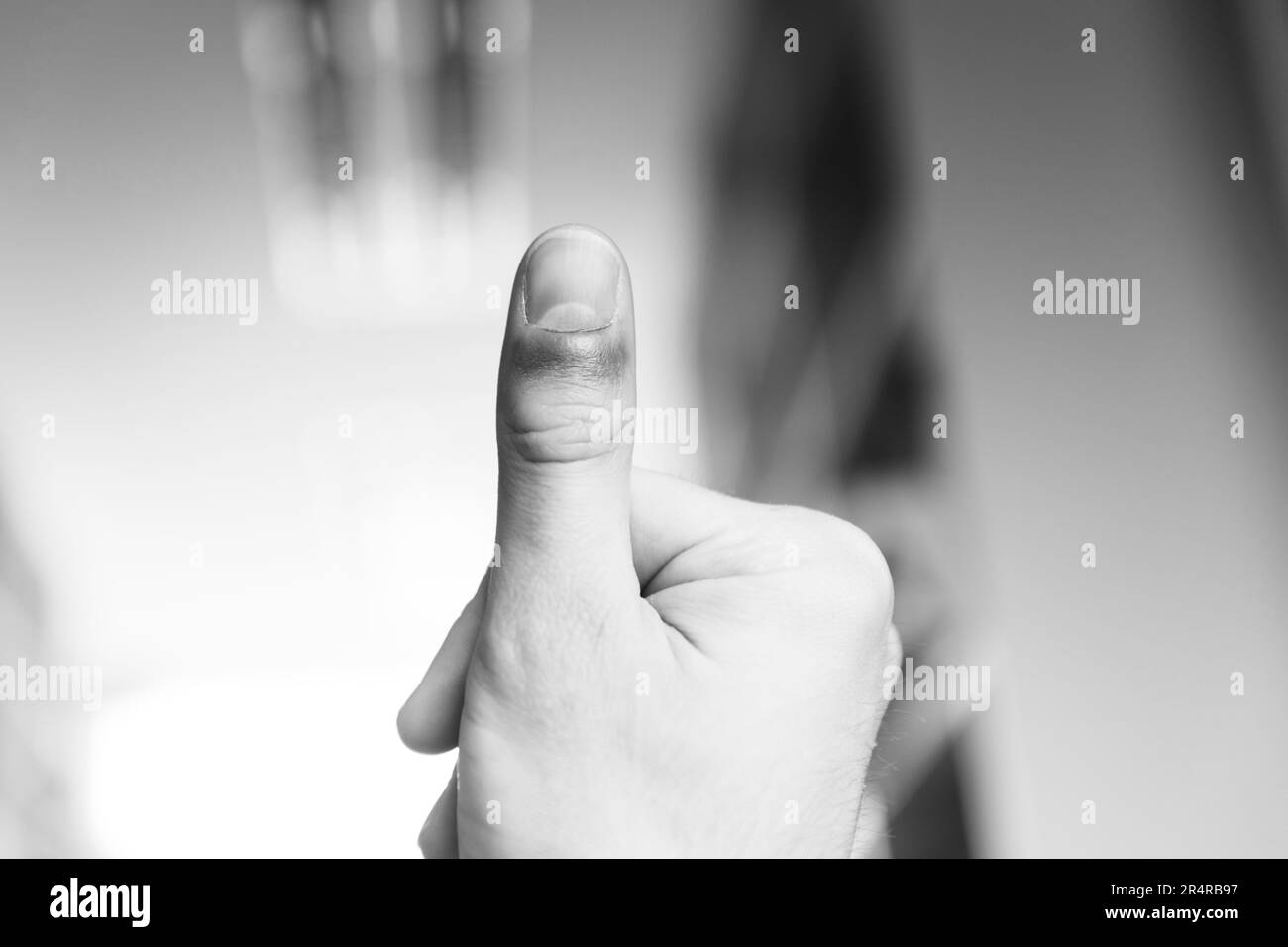 Man Suffering From Hand and Finger in Pain With Red Highlight Stock ...