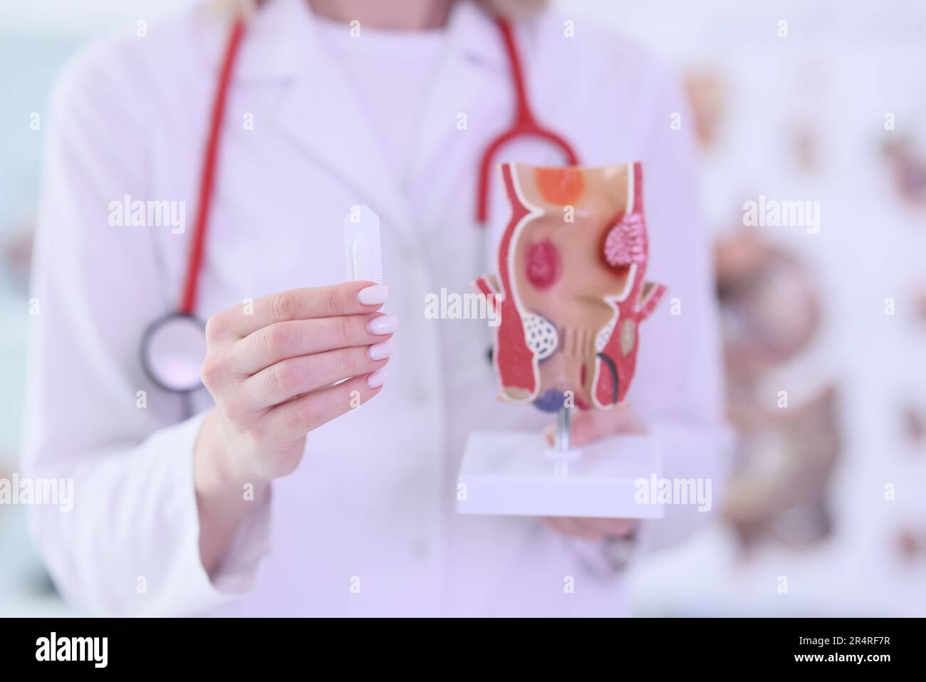Female doctor with stethoscope shows picture of sick rectum Stock Photo ...