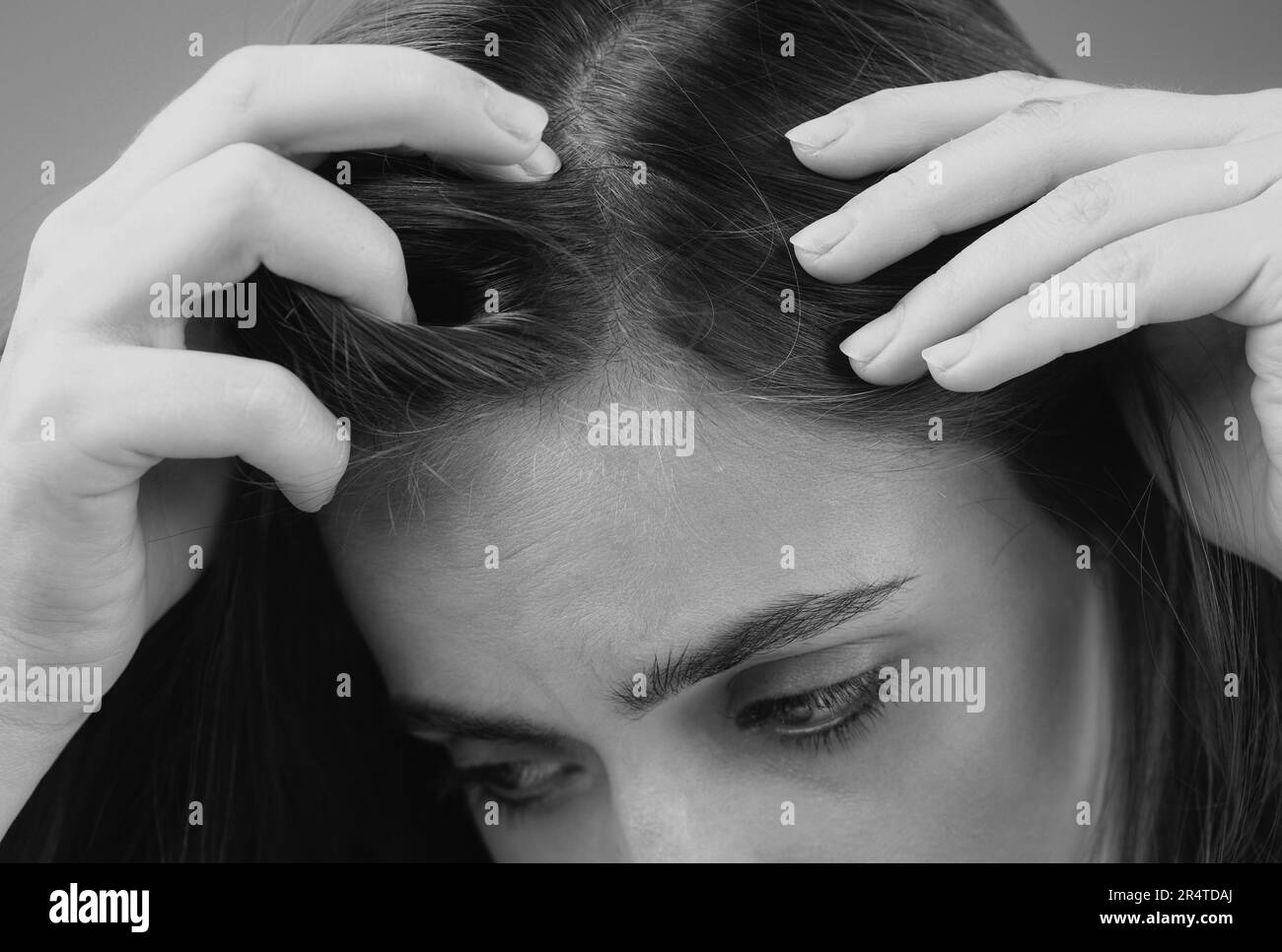 Sad woman with hair loss problem worried about hair loss Stock Photo ...