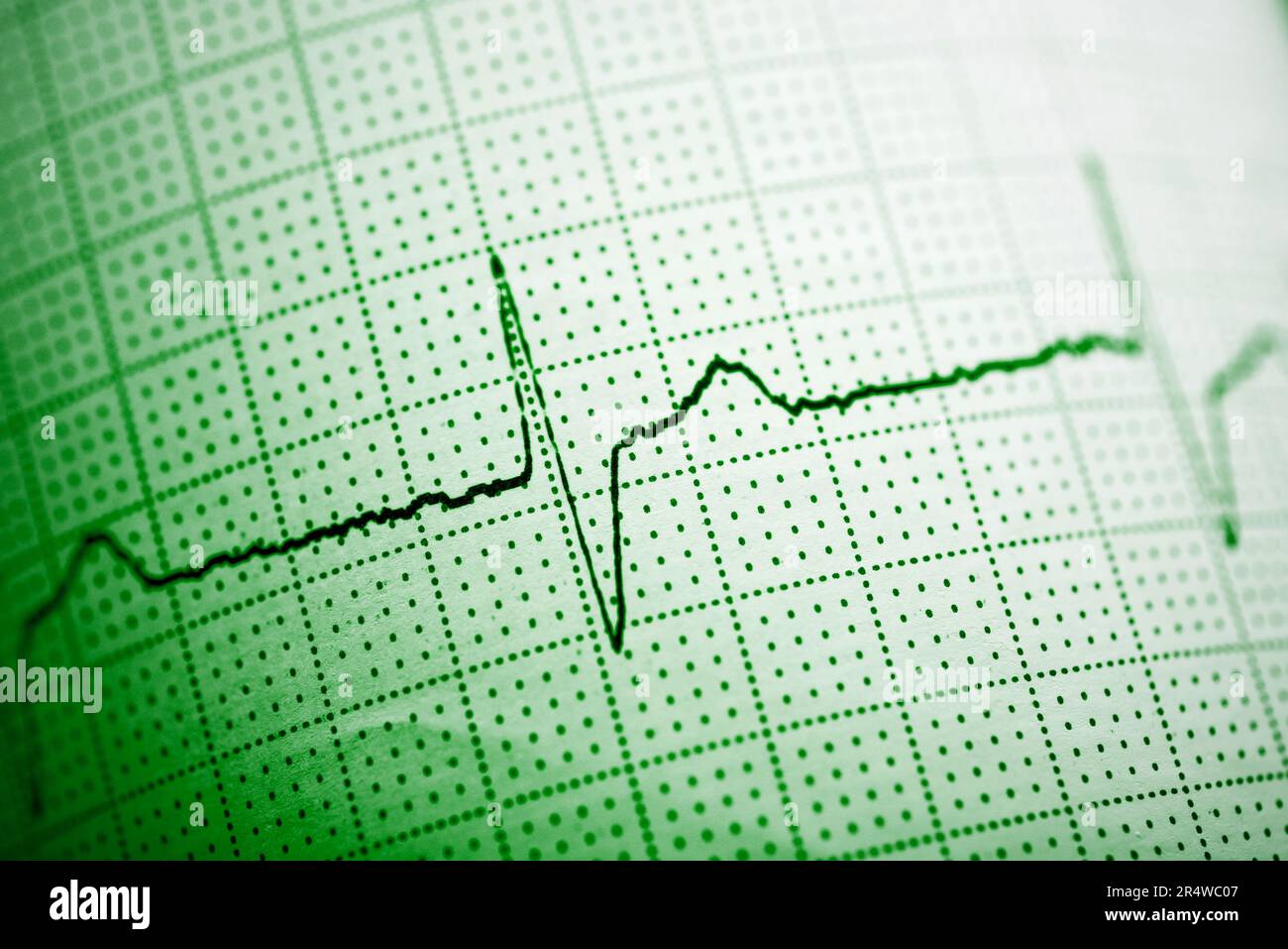 Human heart beat trace hi-res stock photography and images - Alamy