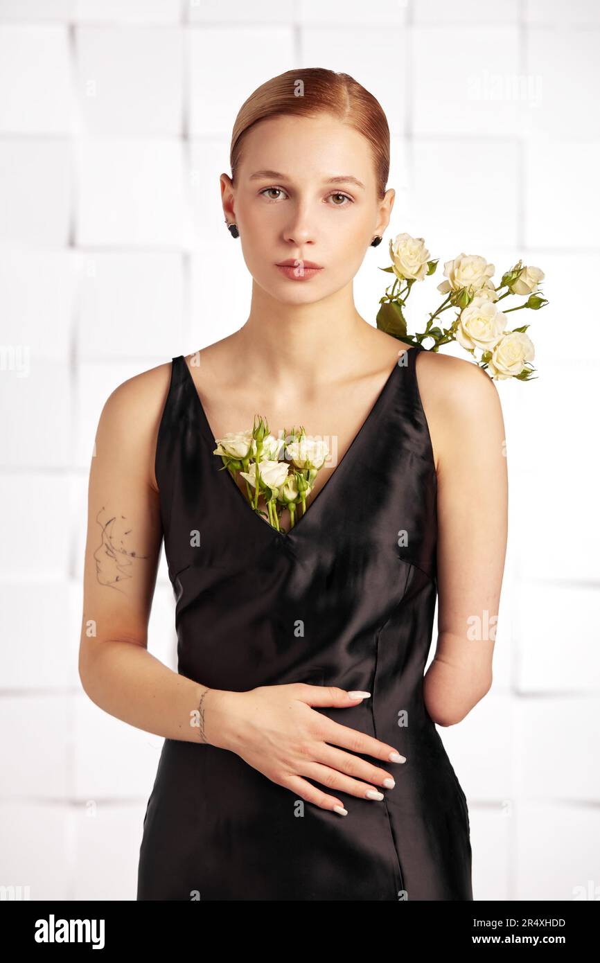 Young and beautiful girl without hand - disabled, look - woman Stock ...