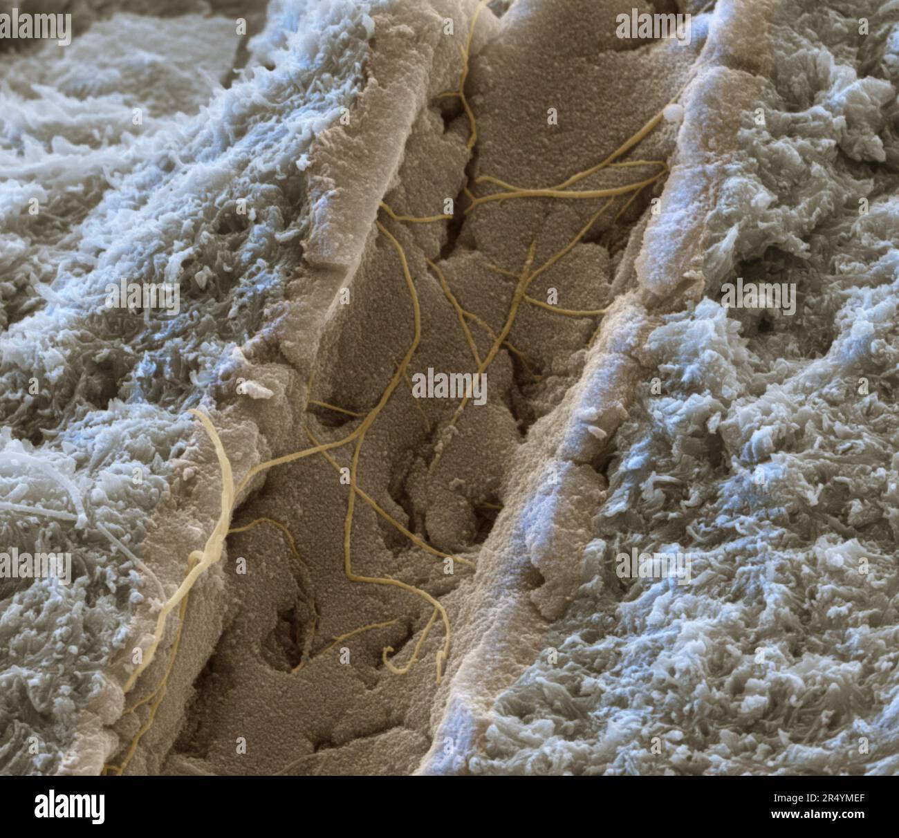 Coloured scanning electron micrograph (SEM) of a fracture through a ...
