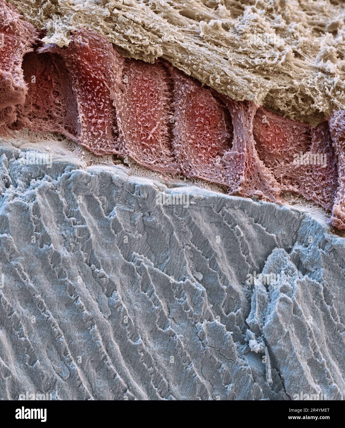Coloured scanning electron micrograph (SEM) of a developing tooth. At ...