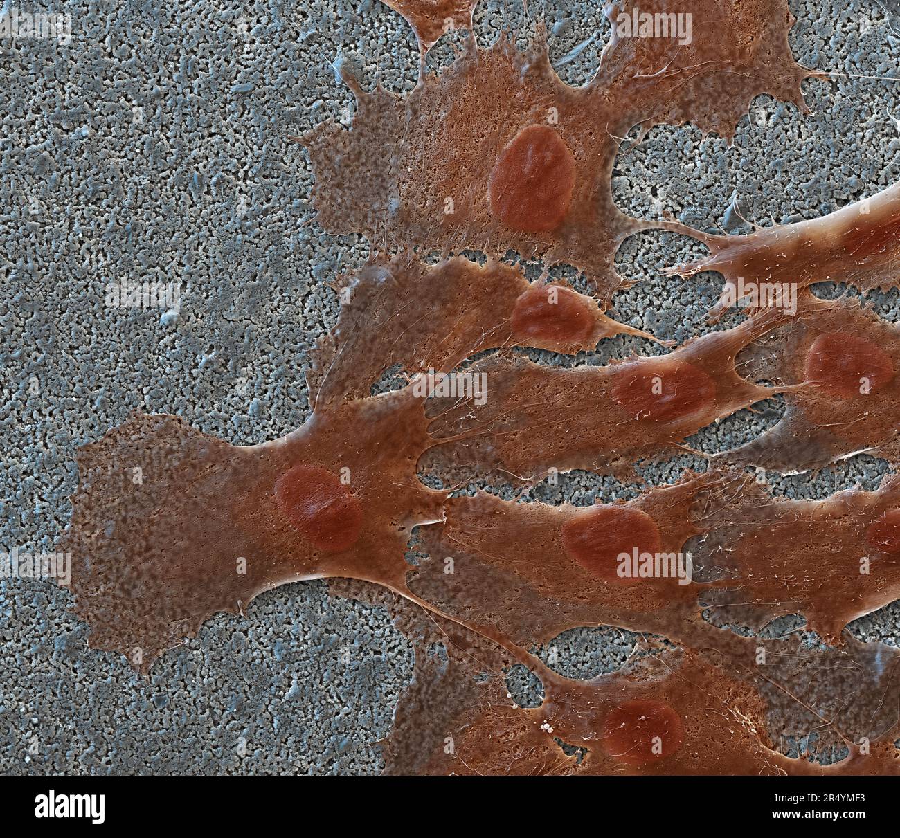 Coloured scanning electron micrograph (SEM) of a bioprinted bone ...