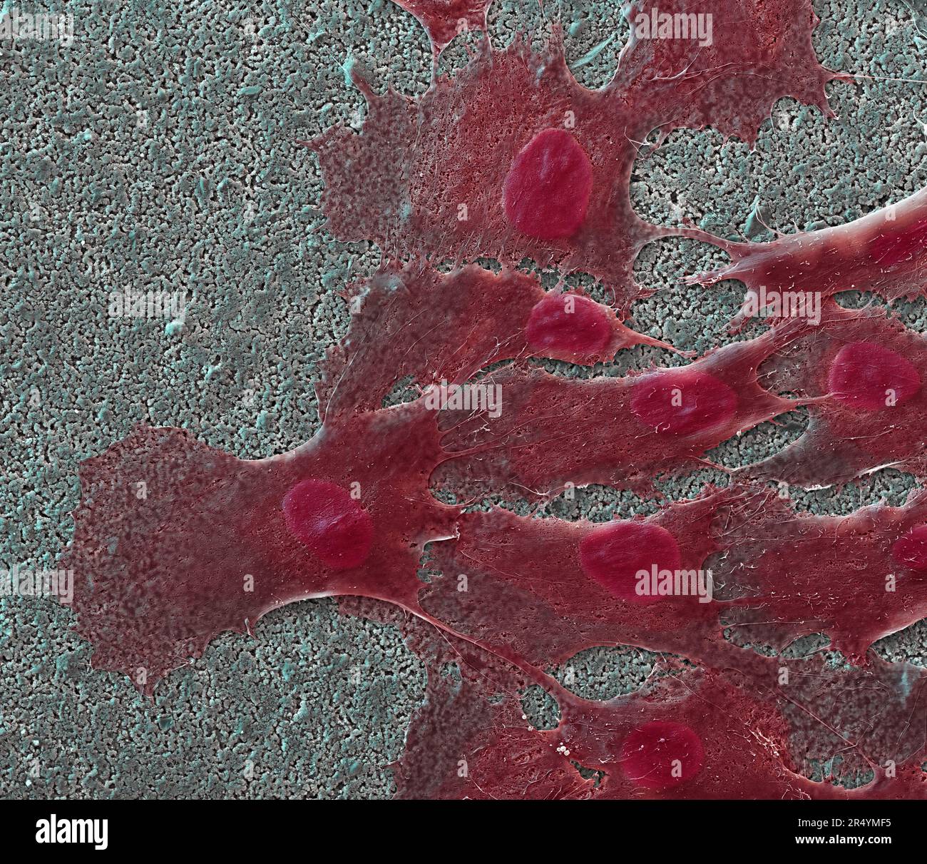 Coloured scanning electron micrograph (SEM) of a bioprinted bone ...