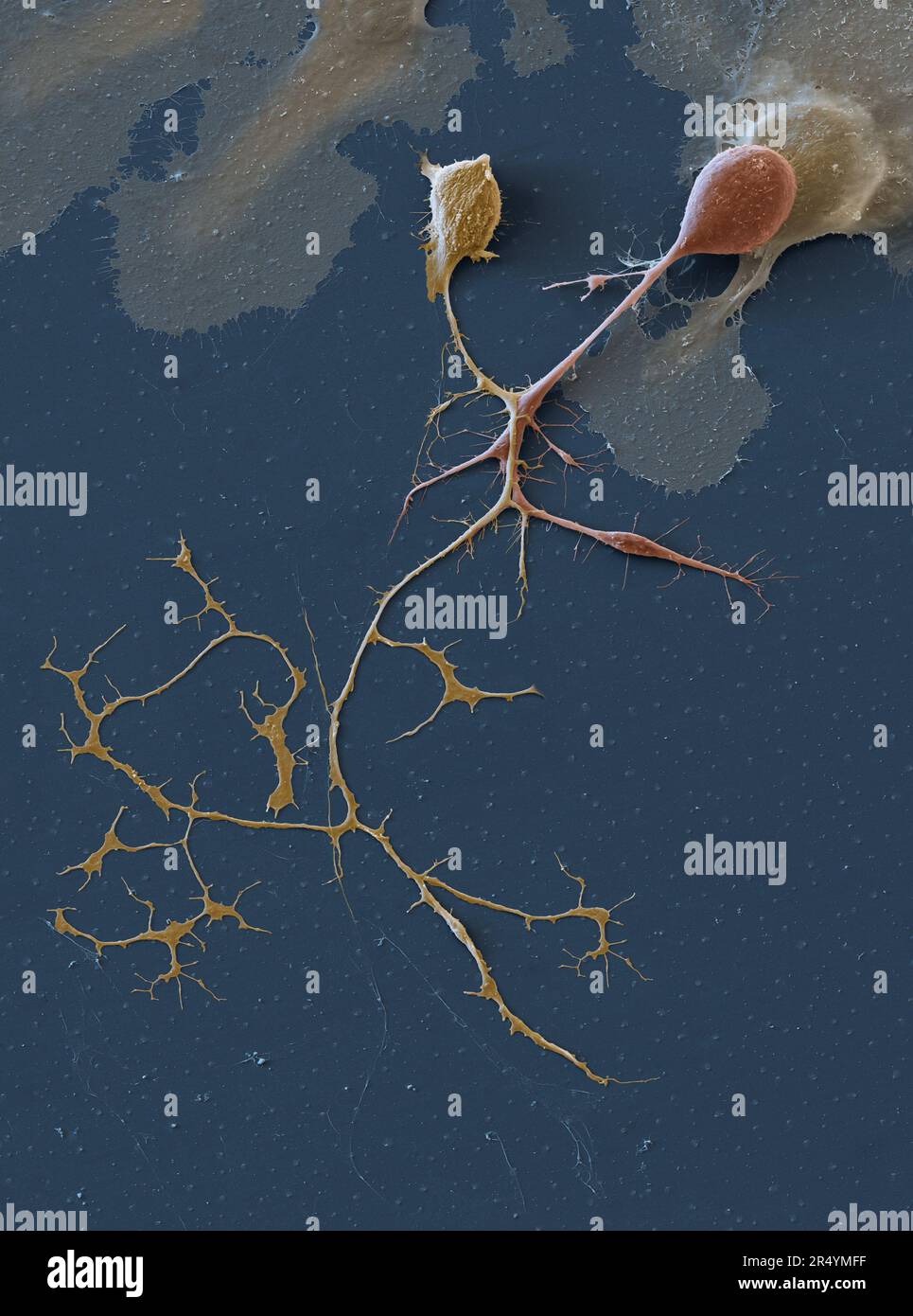 Coloured scanning electron micrograph (SEM) of two spinal ganglion ...