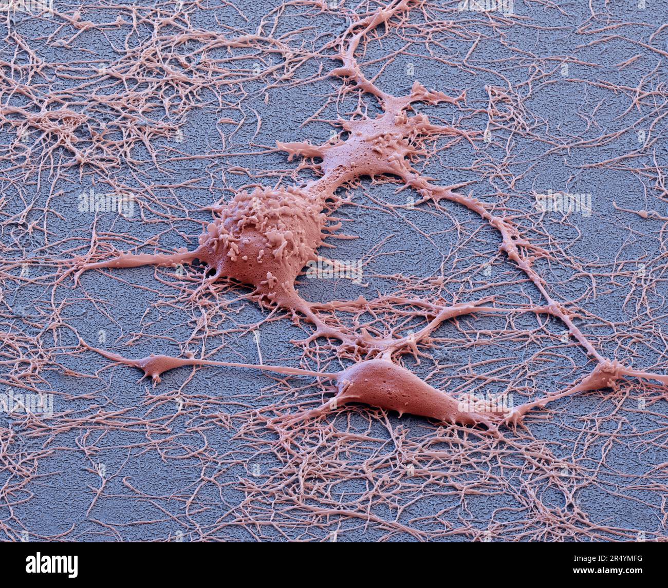 Coloured scanning electron micrograph (SEM) of fibroblast cells grown ...
