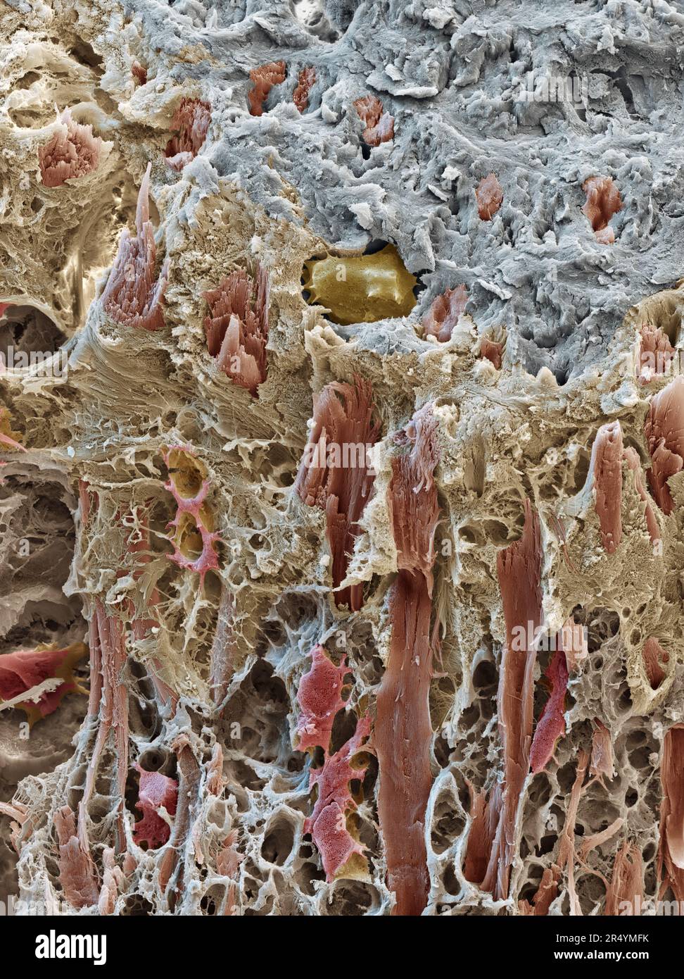 Coloured scanning electron micrograph (SEM) of a freeze-fracture ...