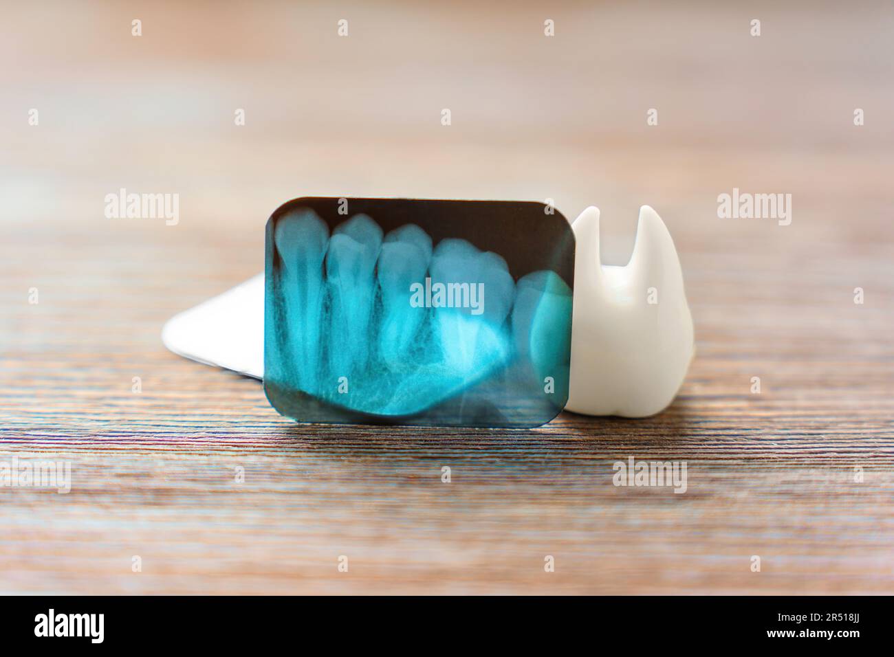 Teeth X-ray and a large white tooth model placed on a wooden background ...