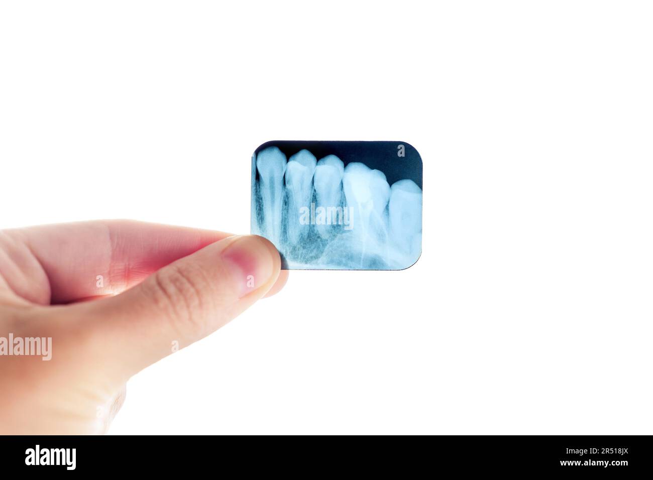 Close-up of a hand holding a dental x-ray film against a lightbox ...