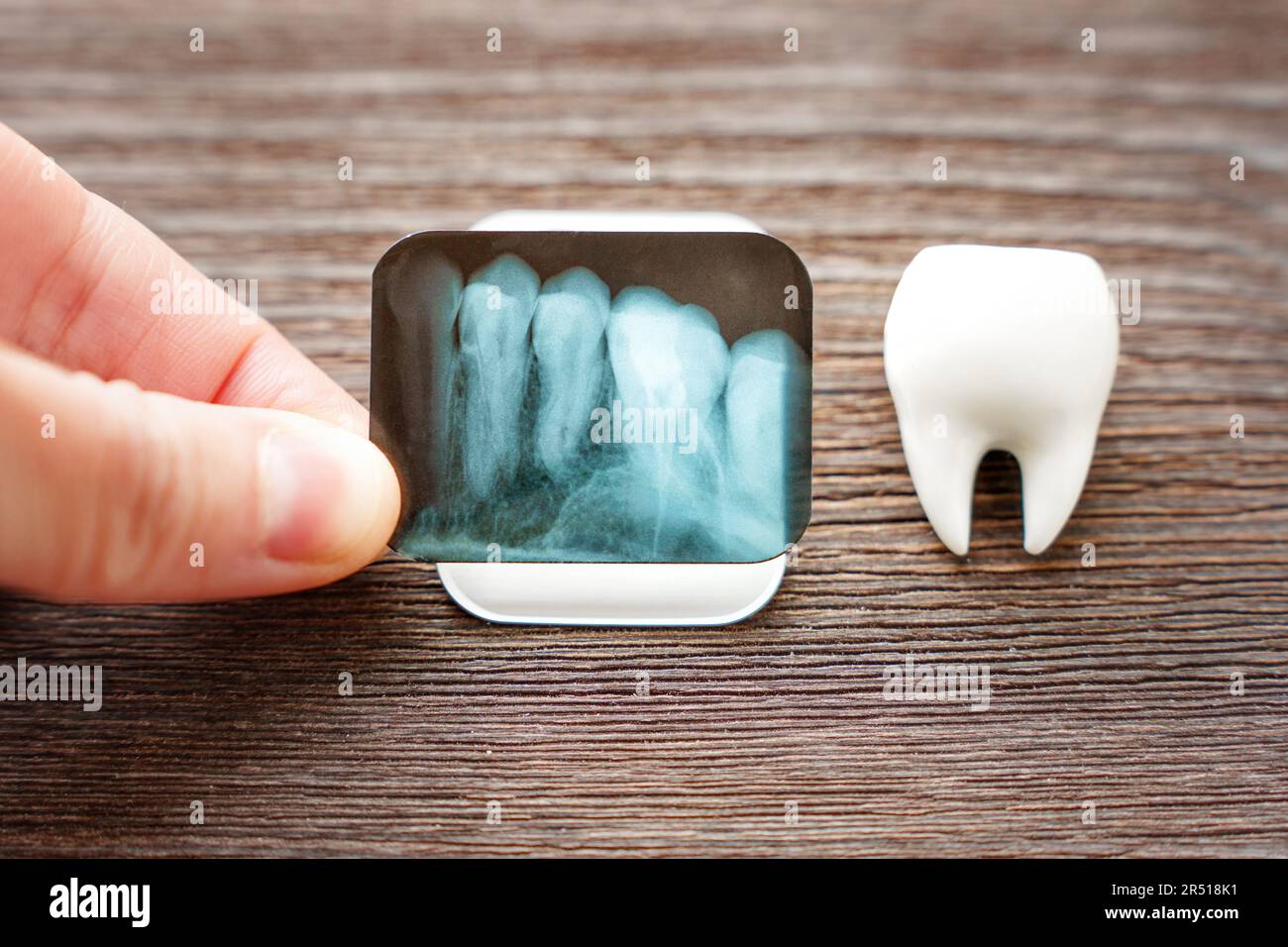 Hand holding an X-ray film of a tooth, with a large white tooth placed ...
